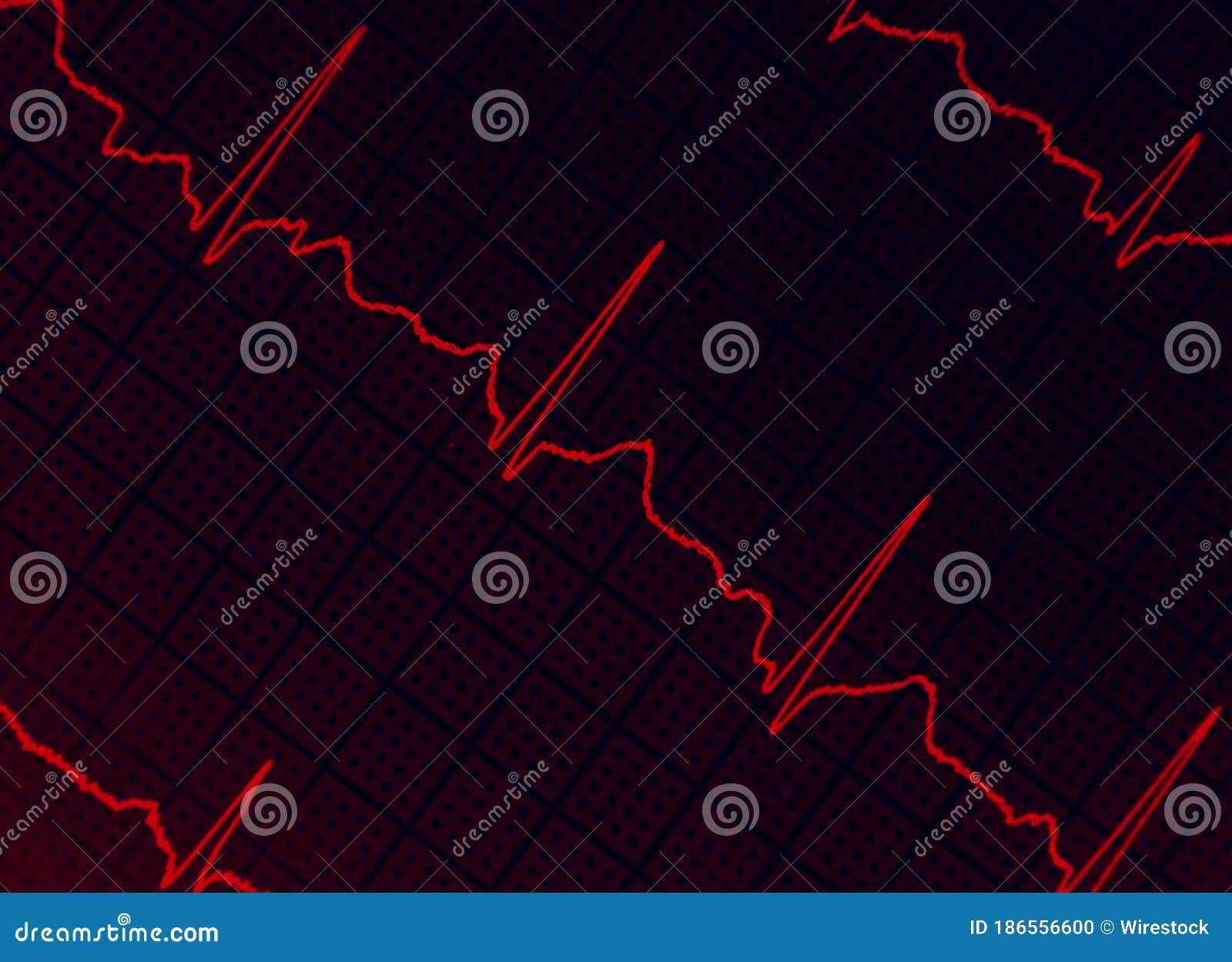 Red Cardiogram on a Black and Red Square Shaped Background Stock Photo ...