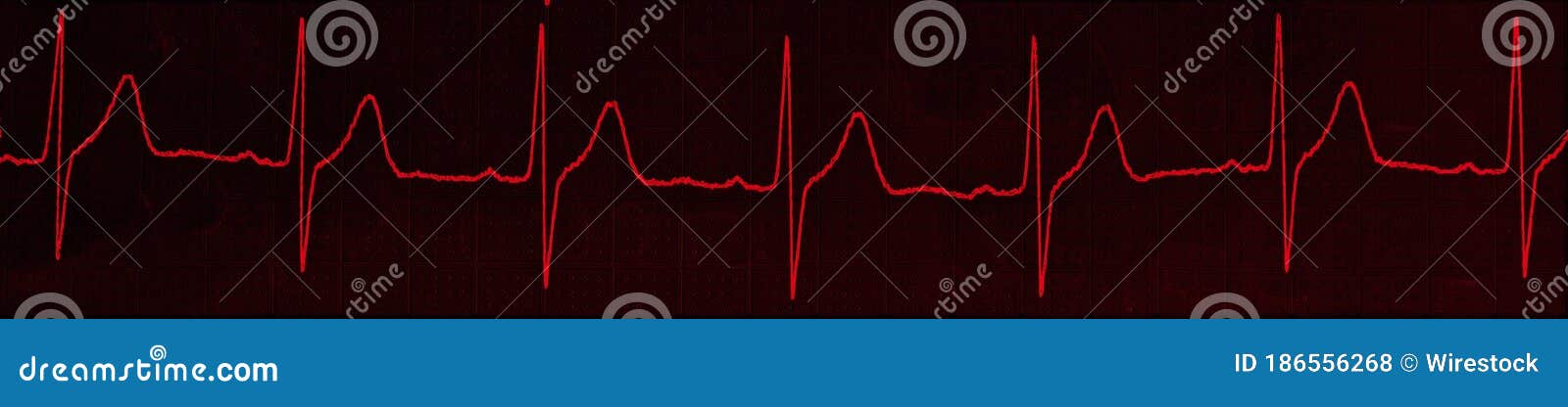 Red Cardiogram Isolated on a Red Background Stock Photo - Image of beat ...