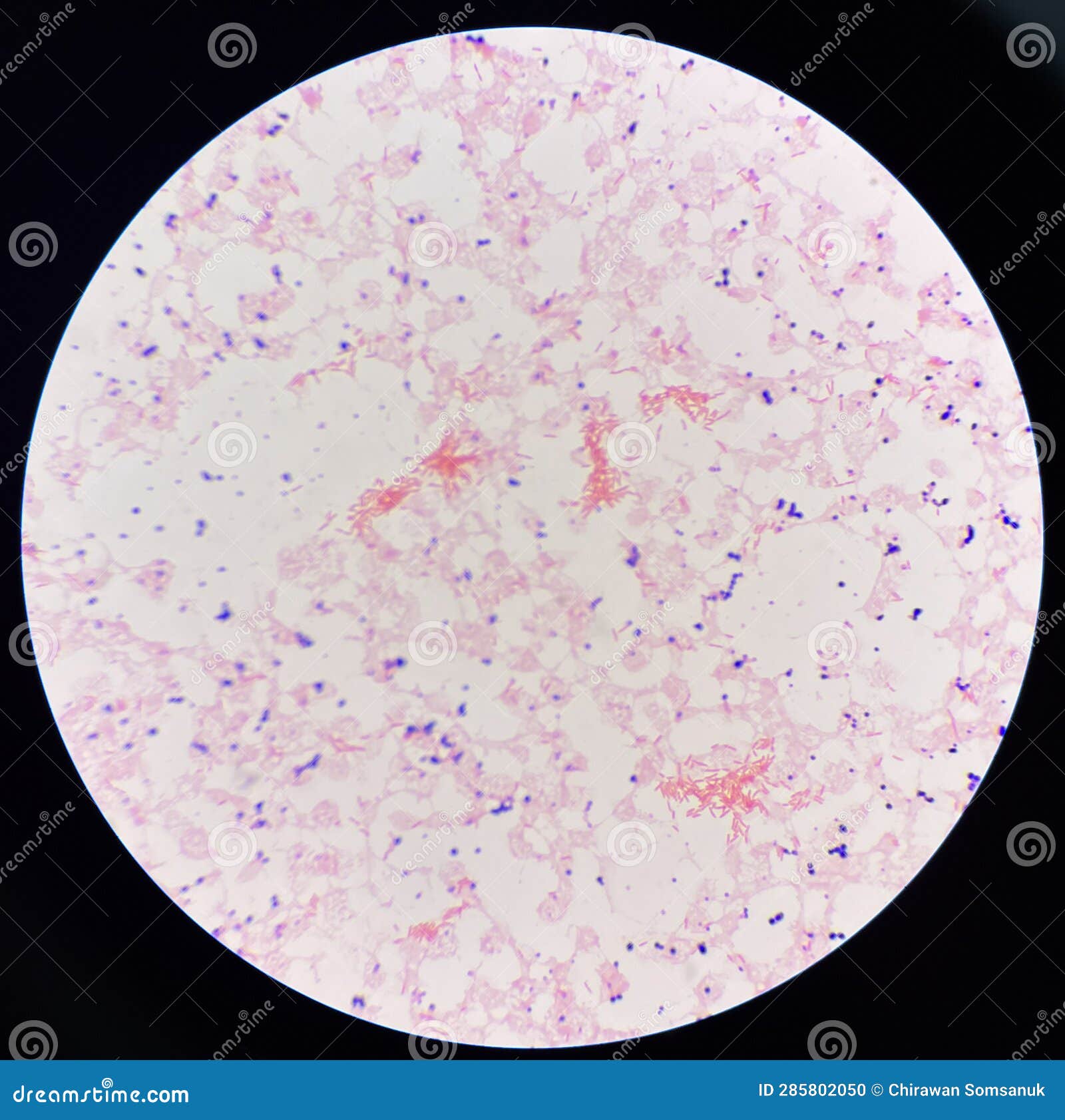 Red Cell Gram Negative Bacilli in Hemo Culture Stock Photo - Image of ...