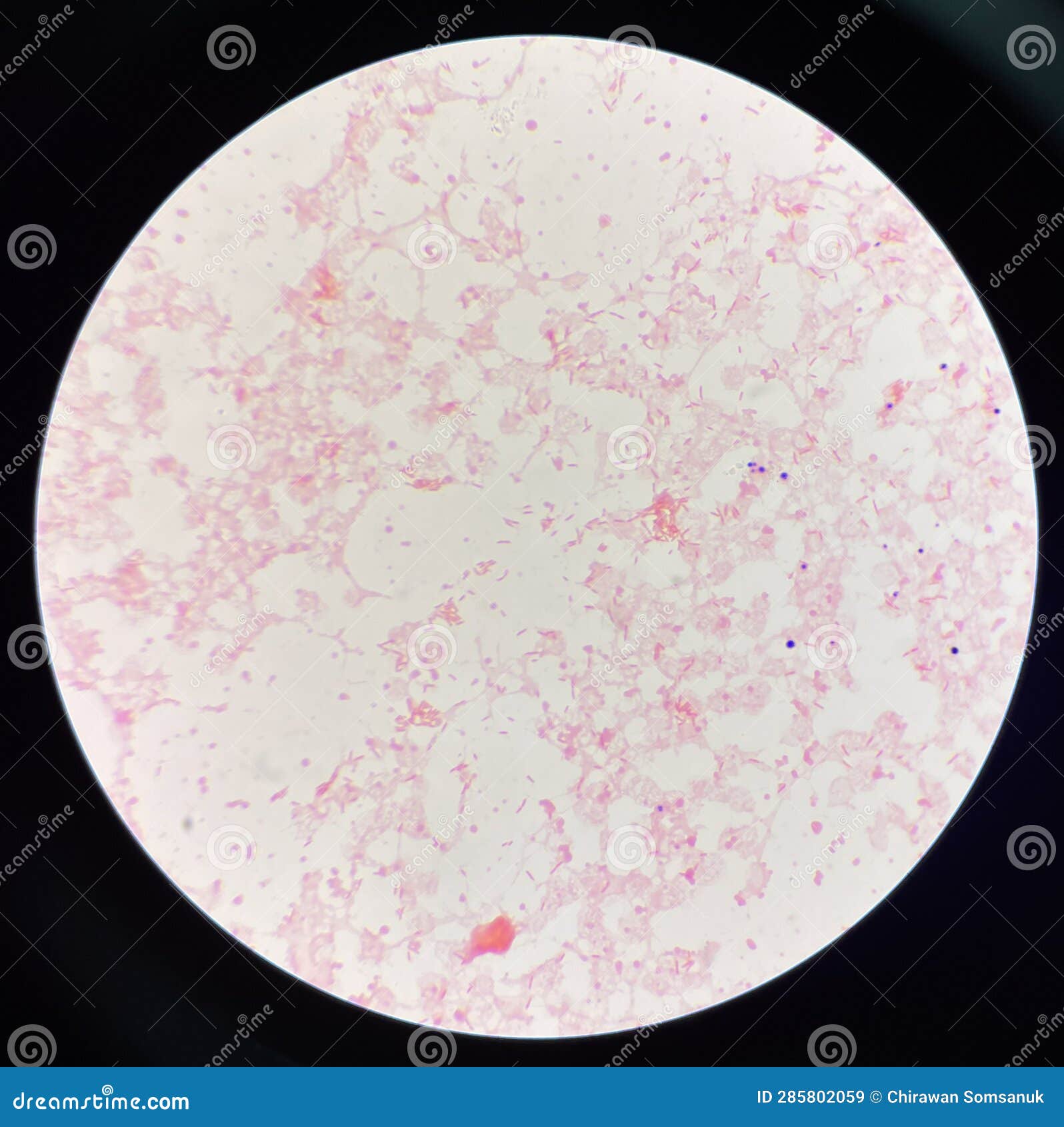 Red Cell Gram Negative Bacilli in Hemo Culture Stock Image - Image of ...