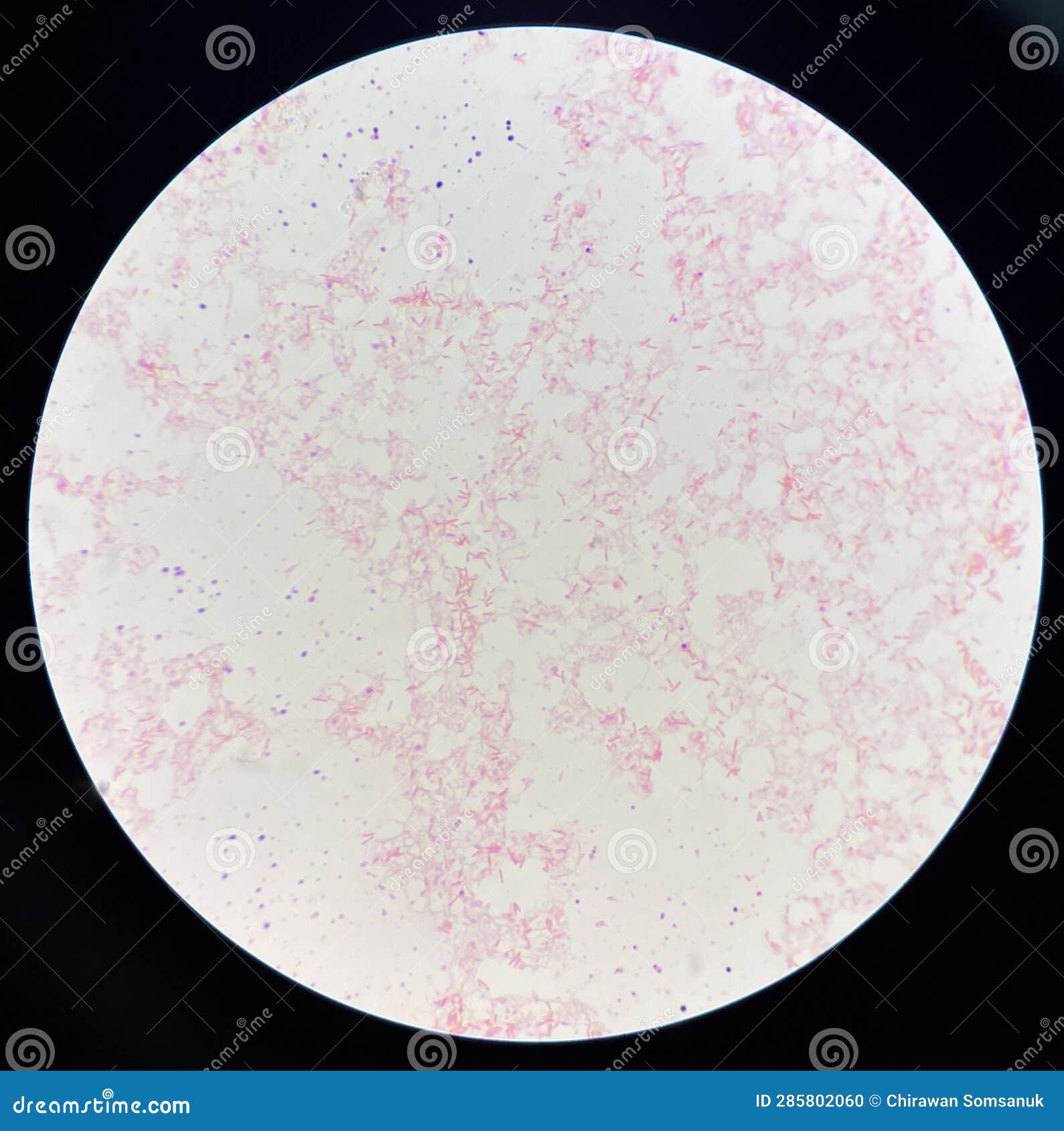 Red Cell Gram Negative Bacilli in Hemo Culture Stock Photo - Image of ...