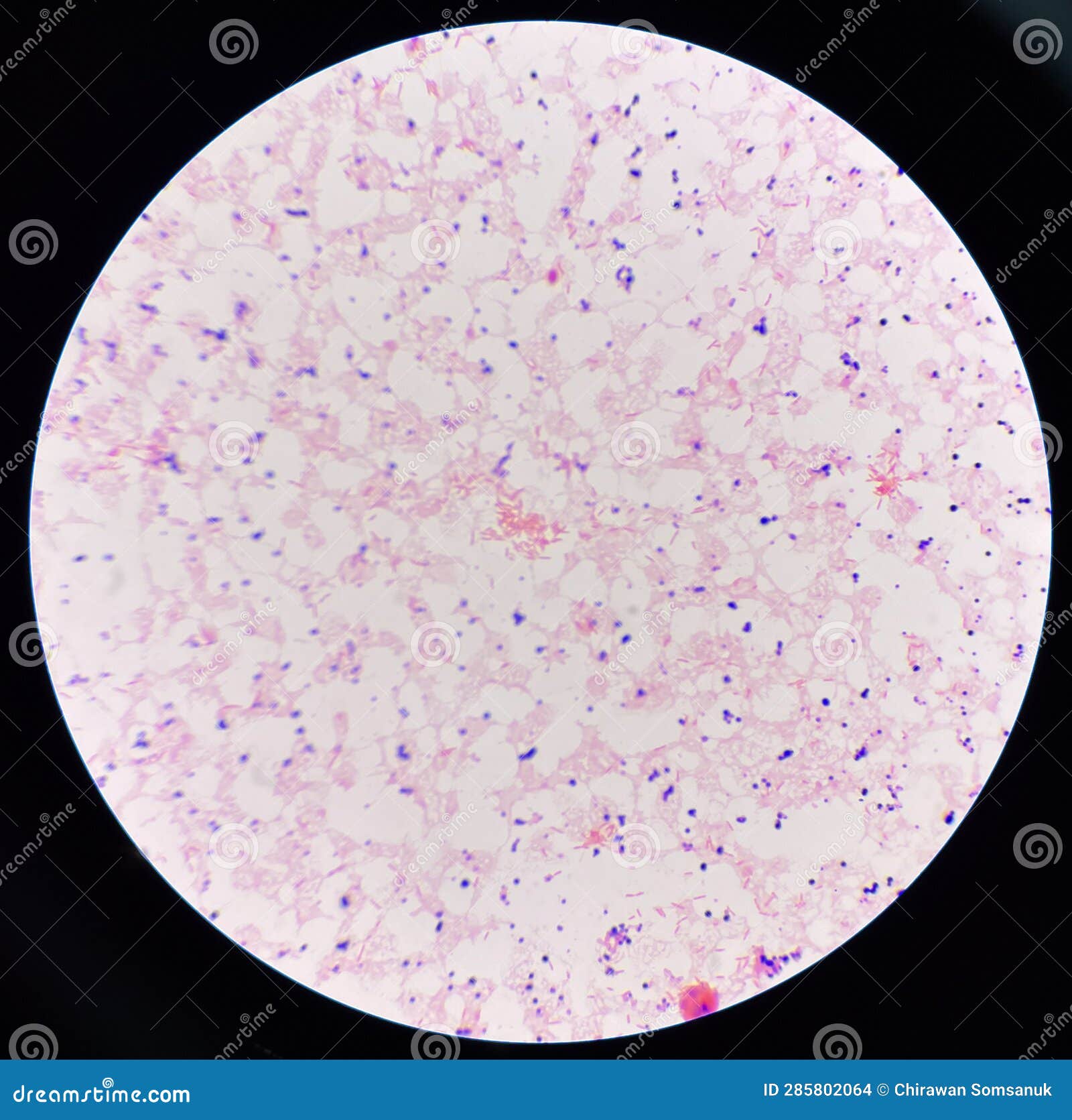 Red Cell Gram Negative Bacilli in Hemo Culture Stock Photo - Image of ...
