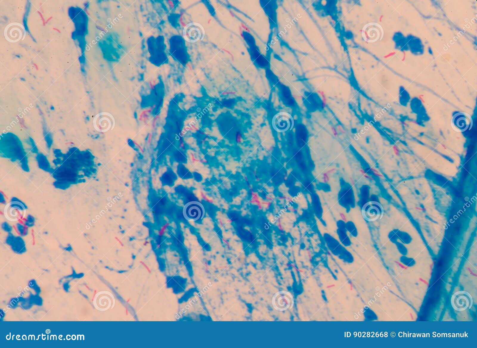 Red Cells Microbacterium Tuberculosis Stock Photo - Image of bacterium ...