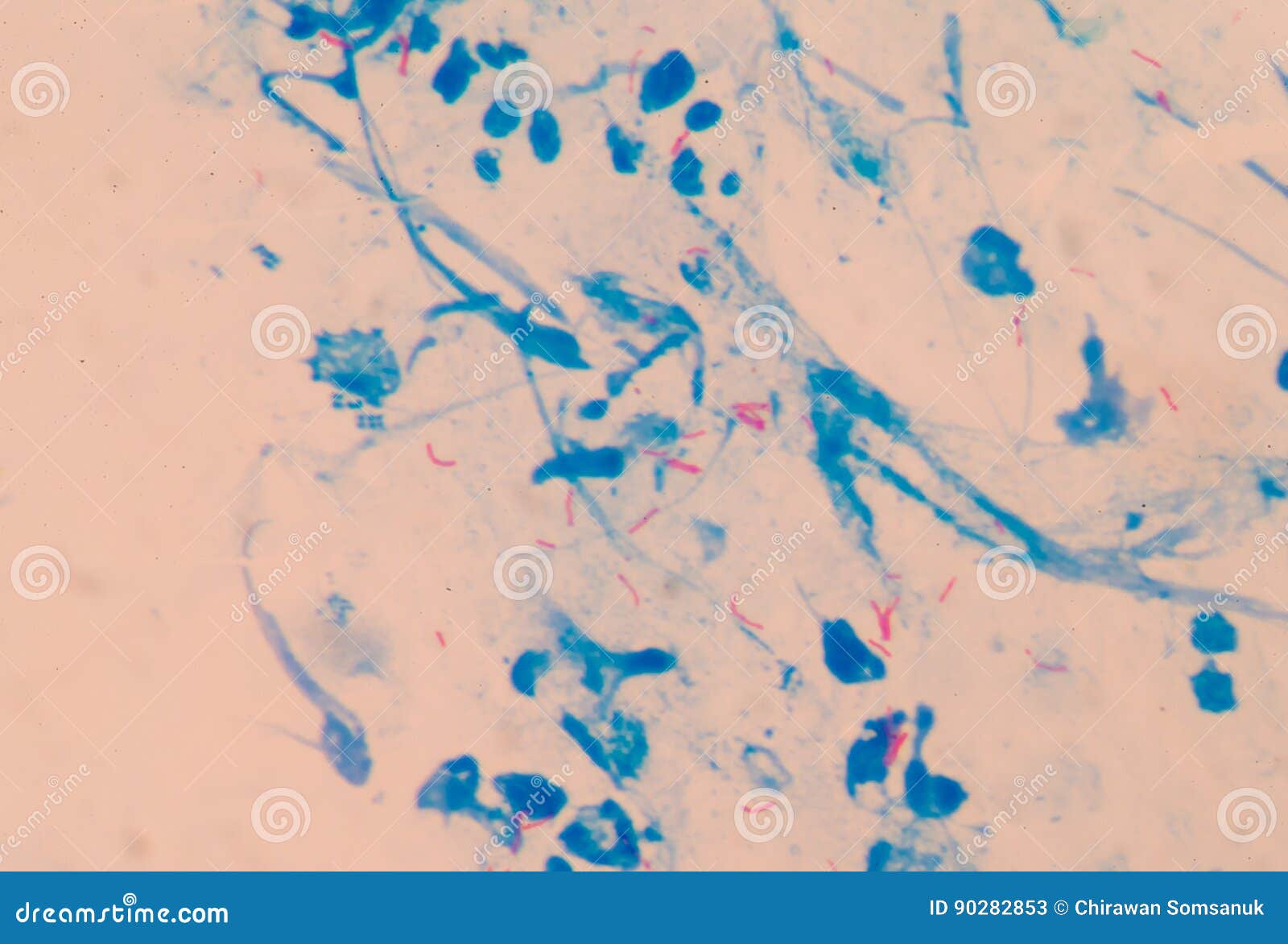 Red Cells Microbacterium Tuberculosis Stock Image - Image of ...