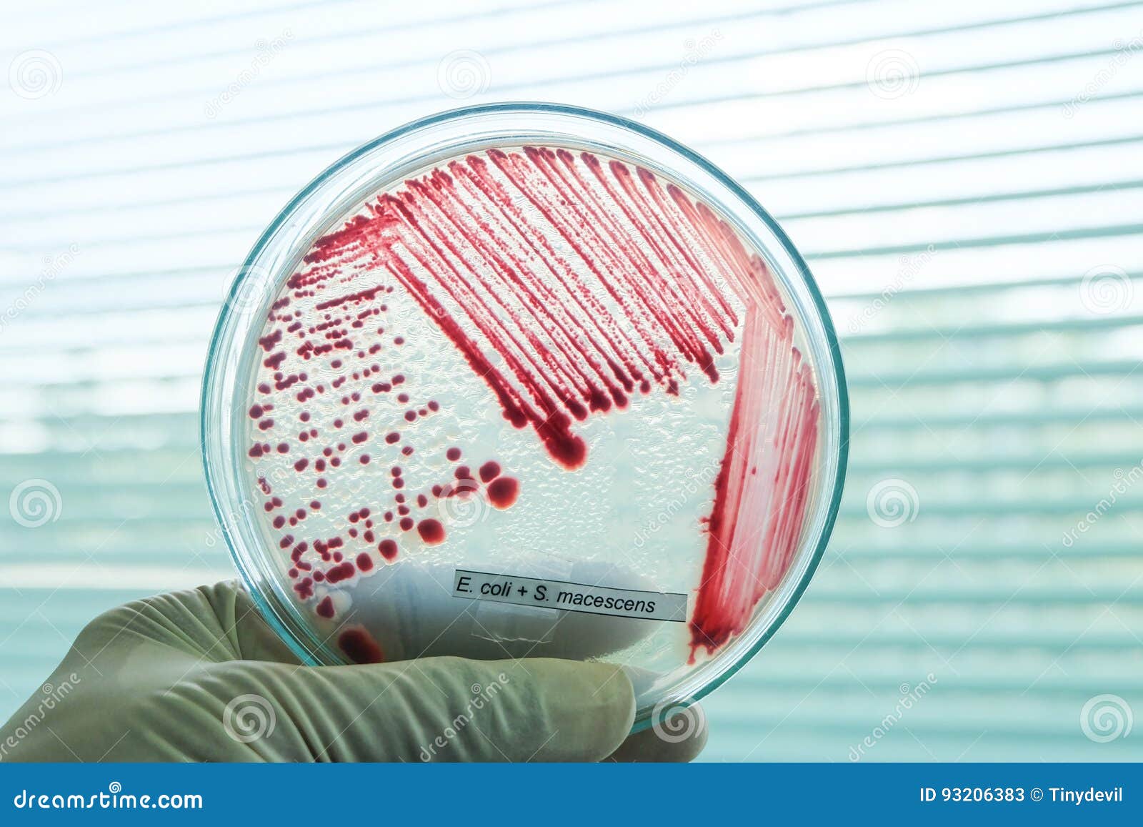 Red colony of bacteria stock image. Image of macro, medicine - 93206383