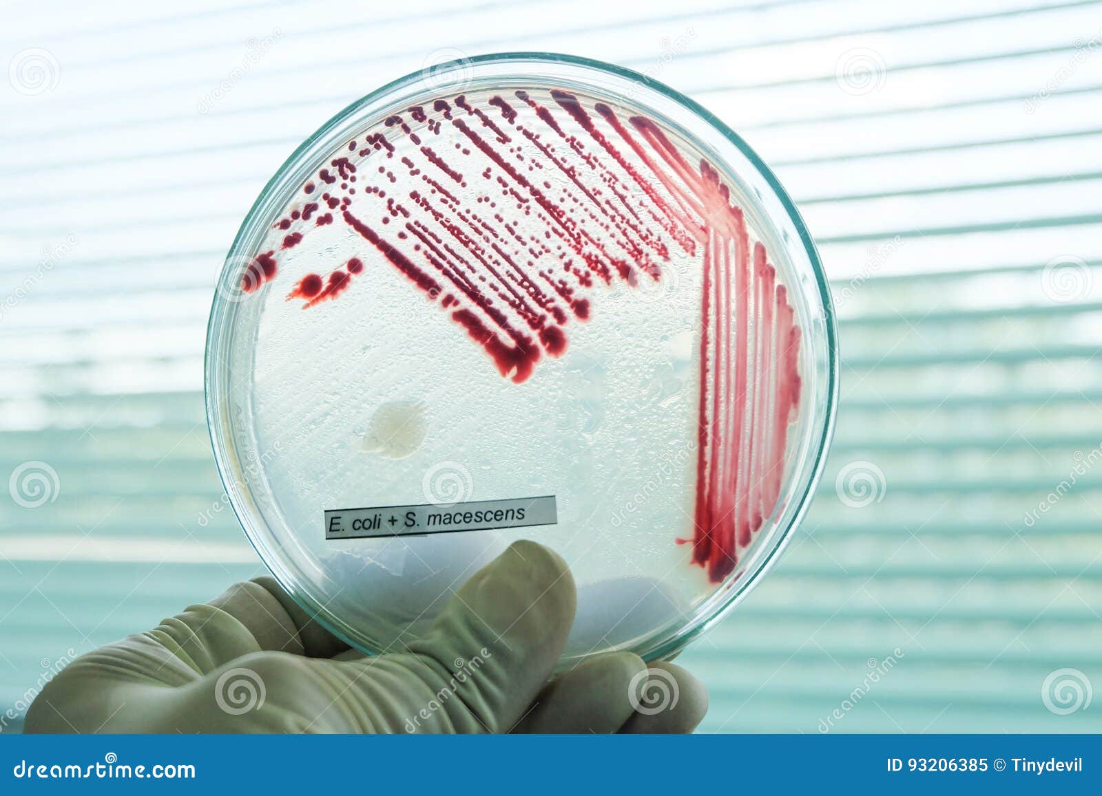 Red colony of bacteria stock image. Image of medicine - 93206385