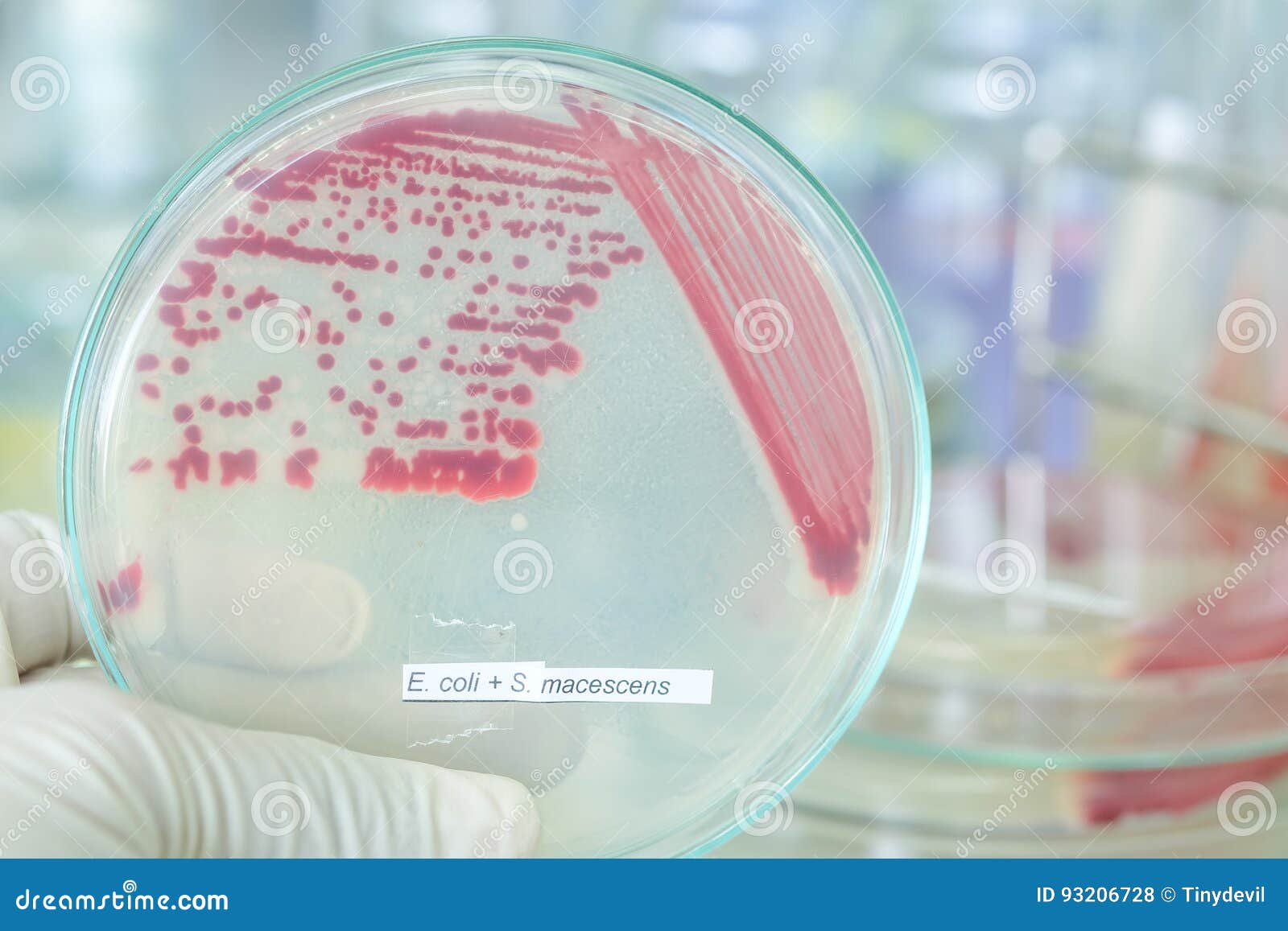 Red colony of bacteria stock photo. Image of grow, biotechnology - 93206728