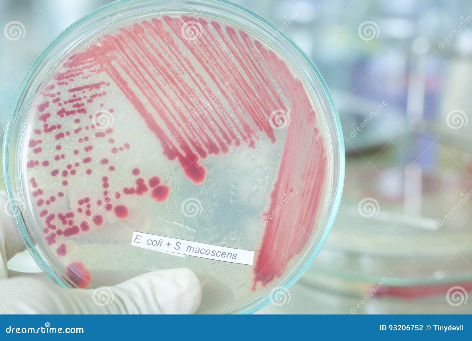 Red colony of bacteria stock photo. Image of molecular - 93206752