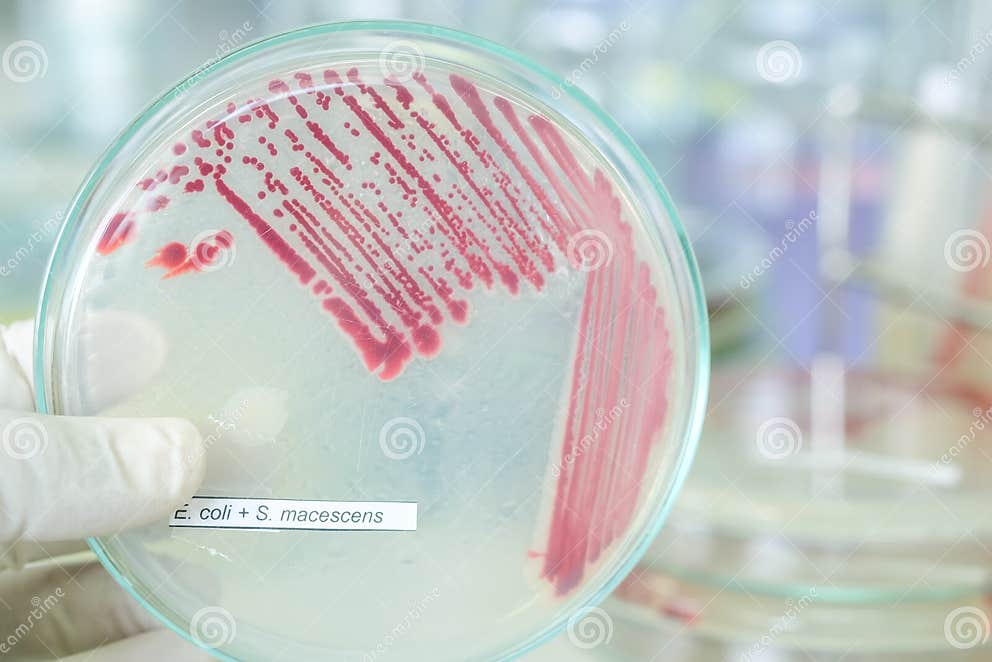 Red colony of bacteria stock photo. Image of biology - 93206754