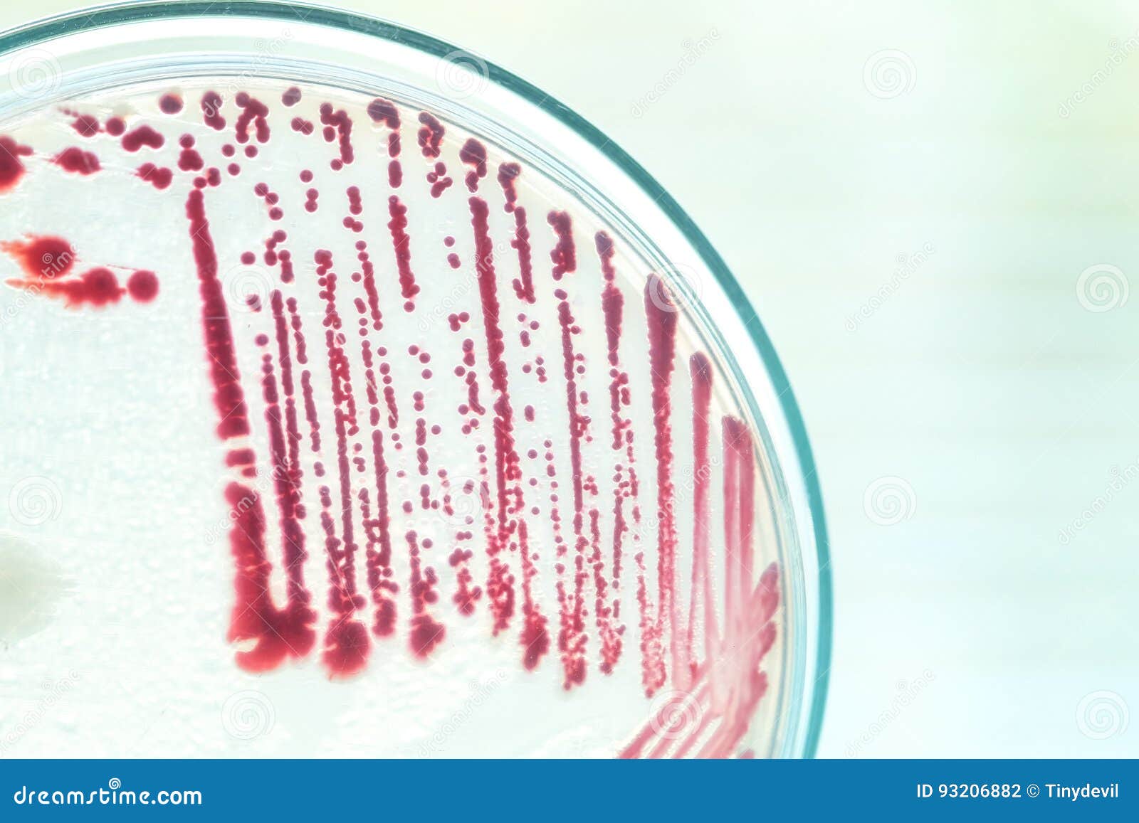 Red colony of bacteria stock photo. Image of biotechnology - 93206882