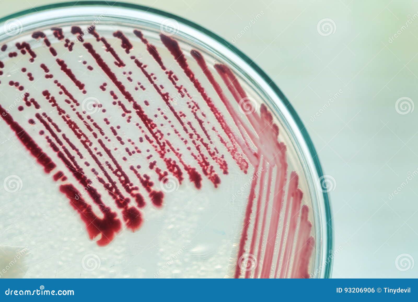 Red colony of bacteria stock photo. Image of drug, healthcare - 93206906
