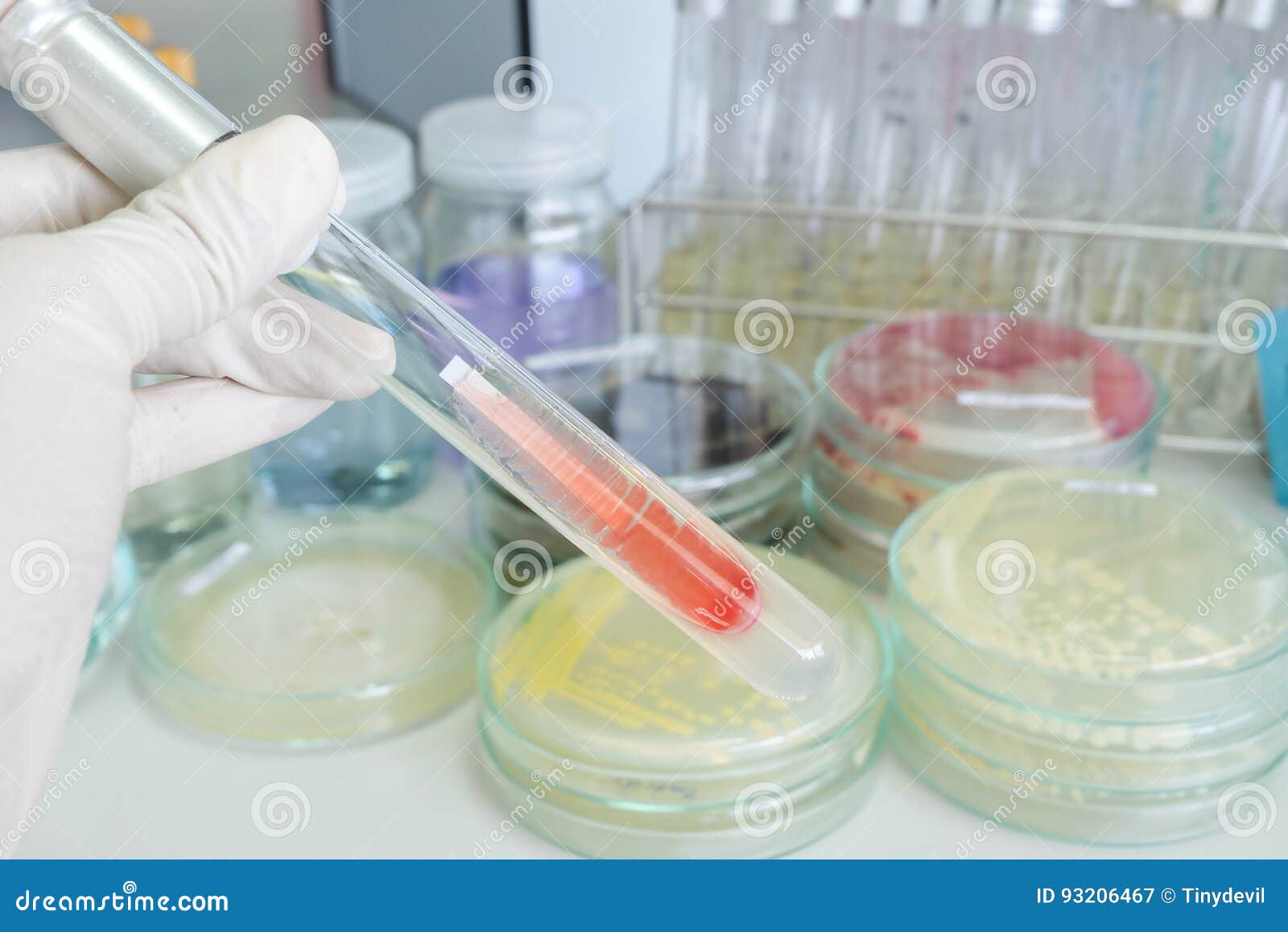 Red Colony of bacteria stock image. Image of macro, investigation ...