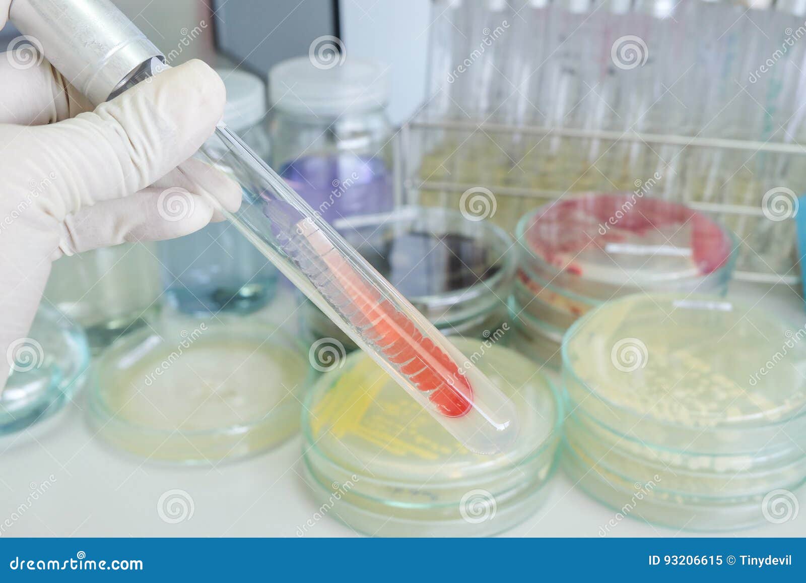 Red Colony of bacteria stock image. Image of culture - 93206615