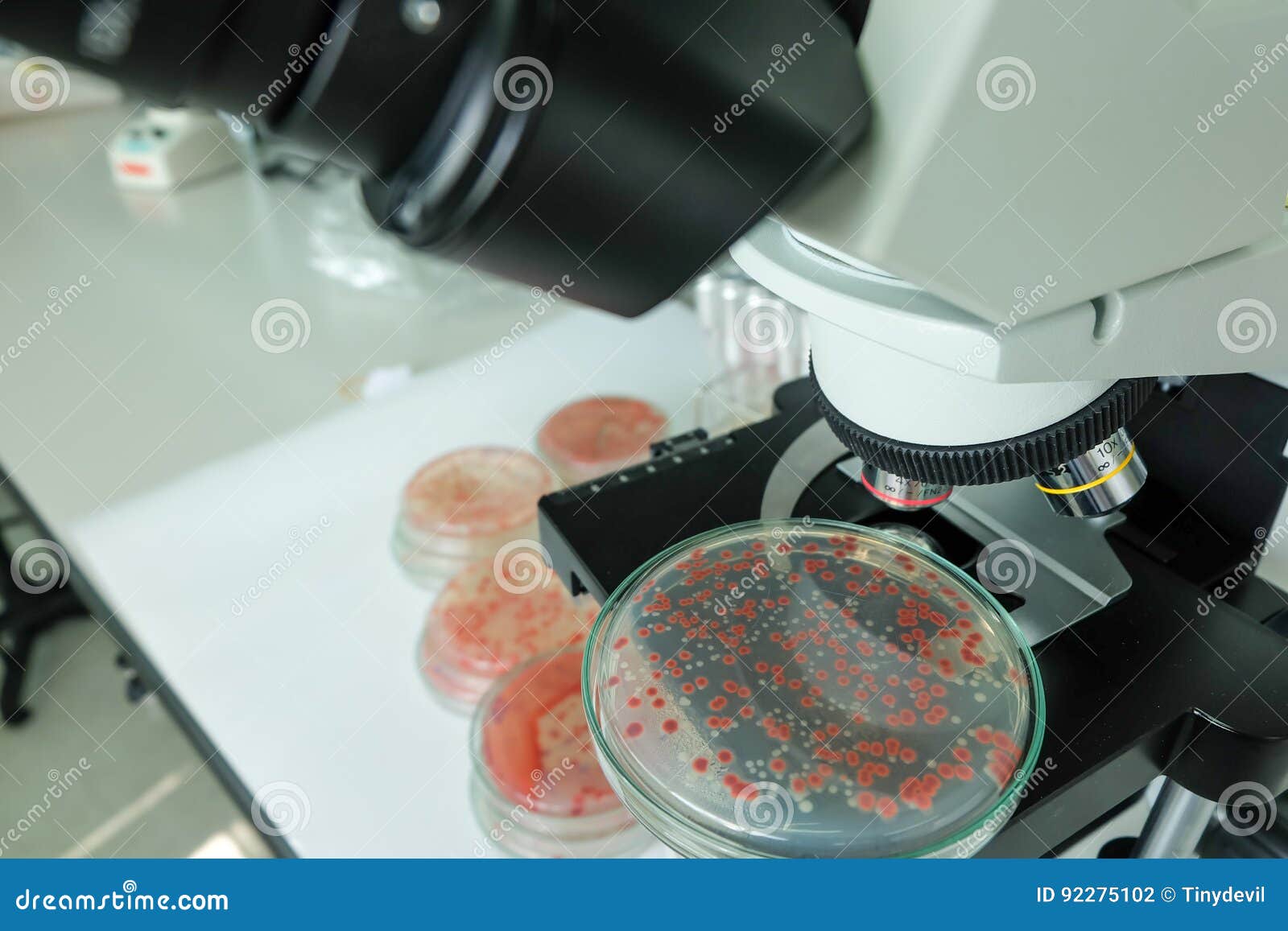 Red Colony of Becteria in Petridish Stock Photo - Image of drug ...