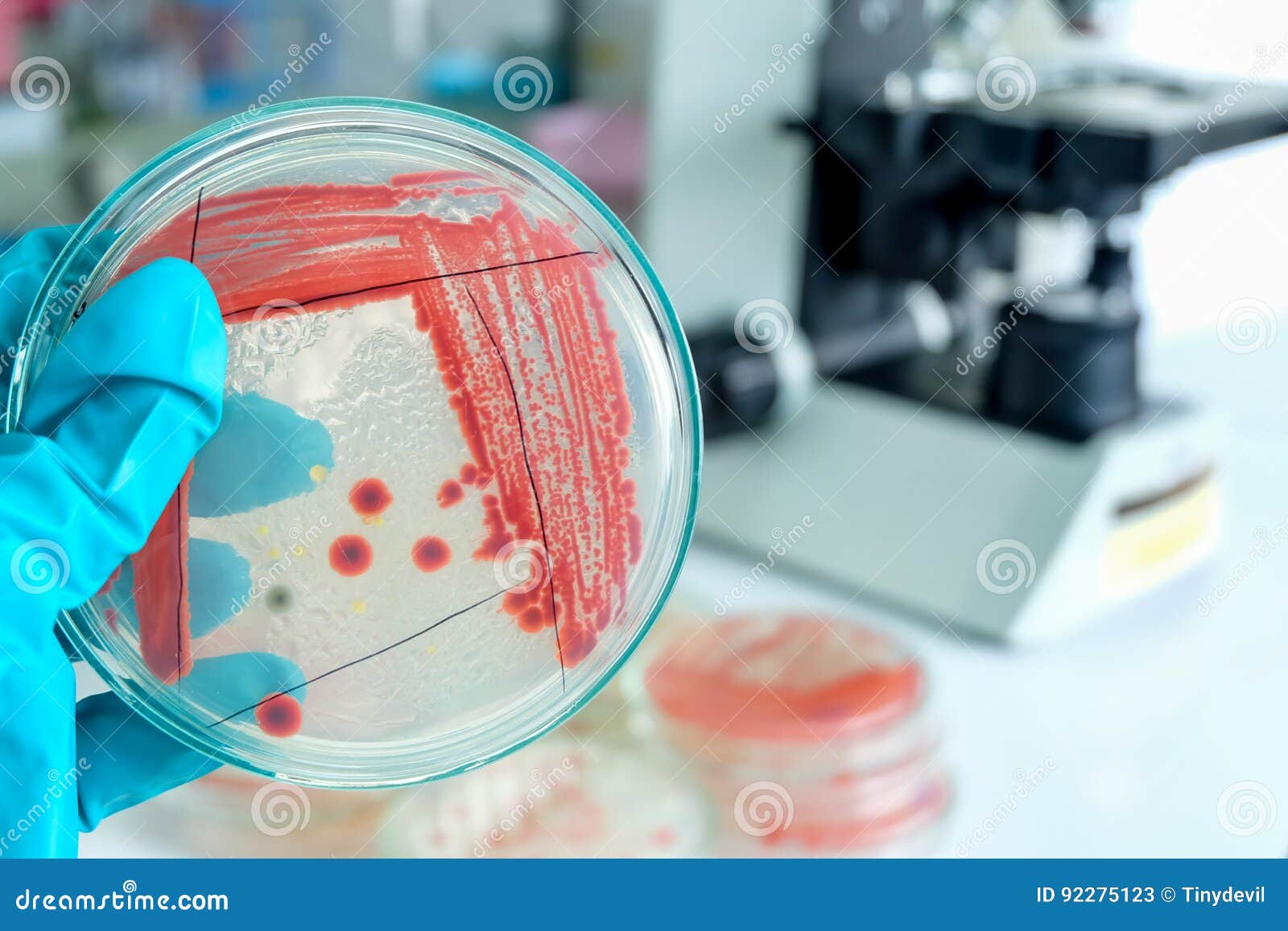 Red Colony of Becteria in Petridish Stock Image - Image of ...