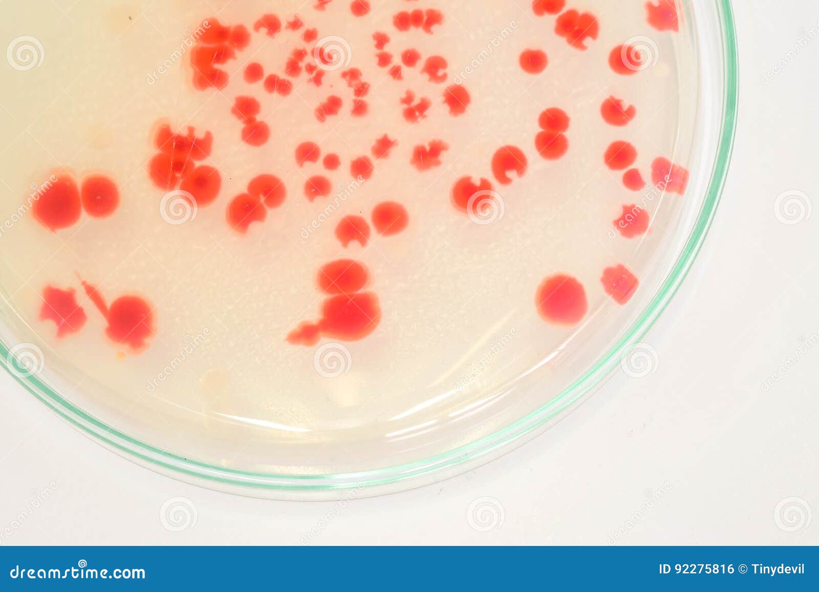 Red Colony of Becteria in Petridish Stock Photo - Image of colony ...