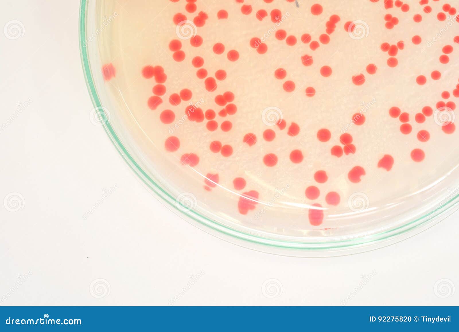 Red Colony of Becteria in Petridish Stock Photo - Image of bacterial ...
