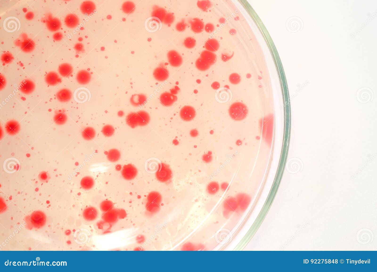 Red Colony of Becteria in Petridish Stock Photo - Image of grow ...