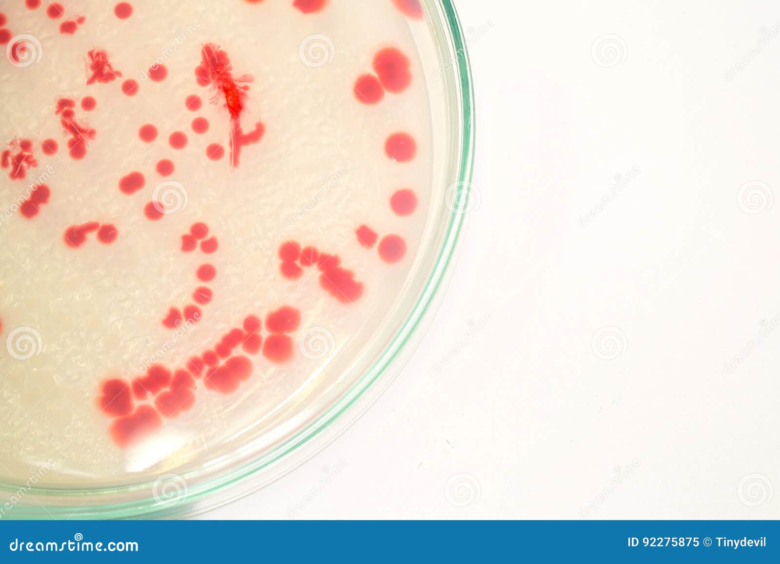 Red Colony of Becteria in Petridish Stock Image - Image of microbiology ...