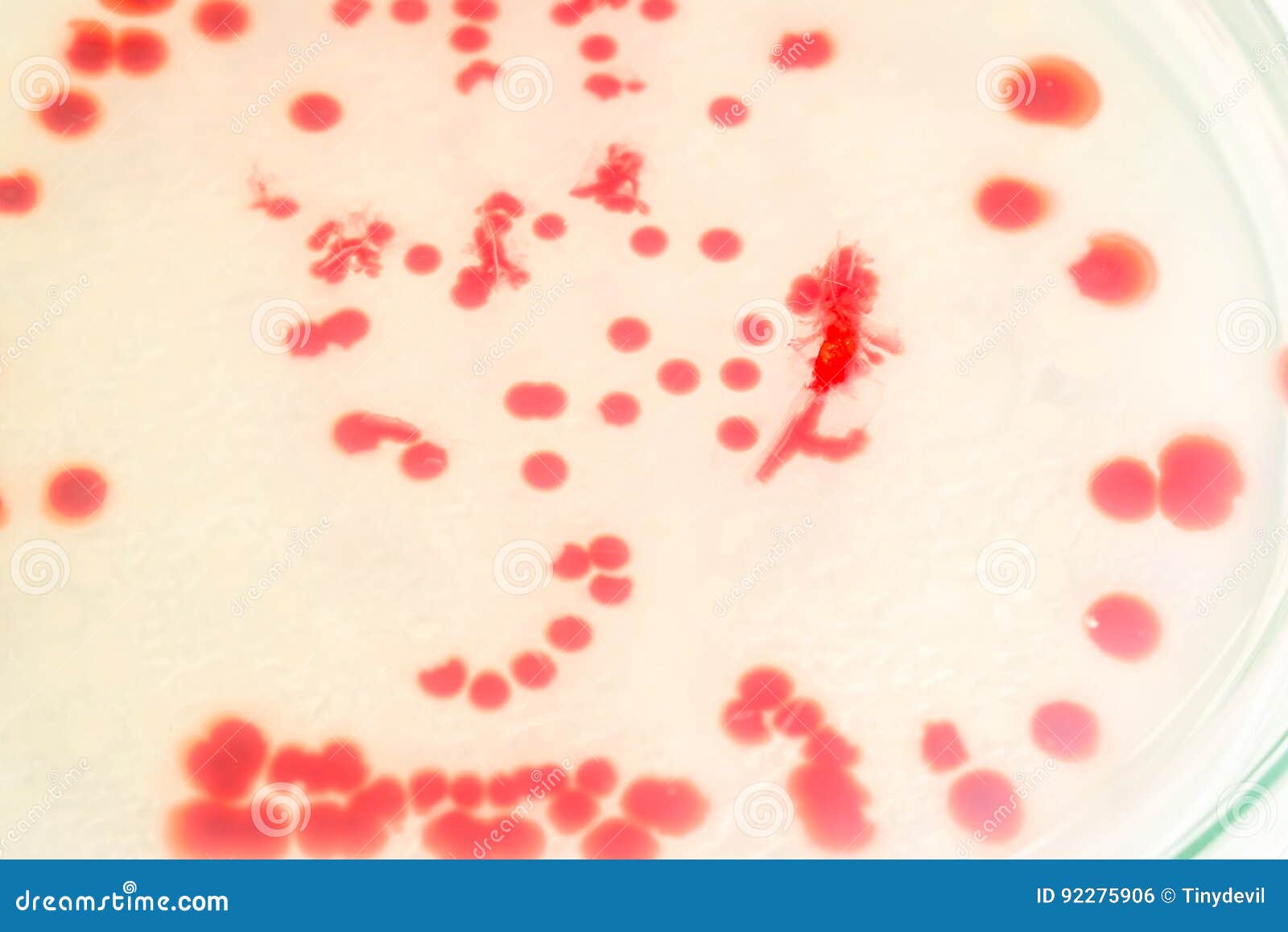 Red Colony of Becteria in Petridish Stock Photo - Image of chemical ...