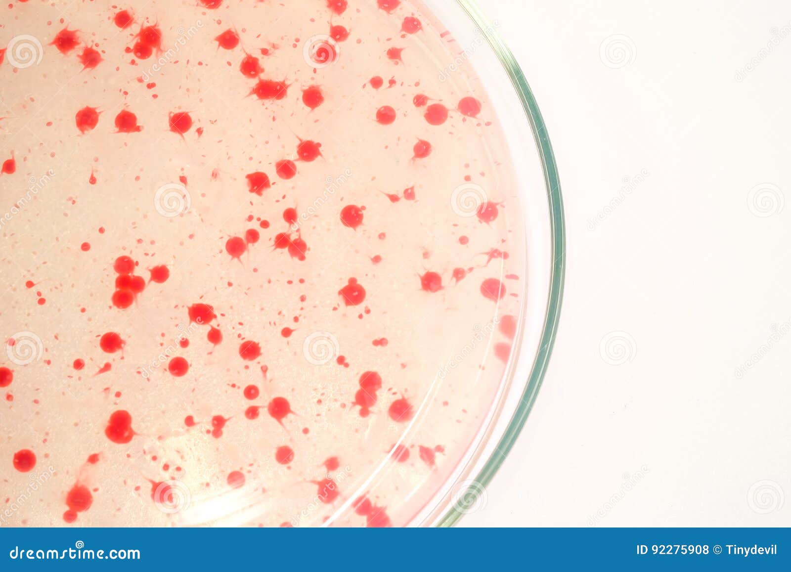 Red Colony of Becteria in Petridish Stock Photo - Image of grow, blue ...
