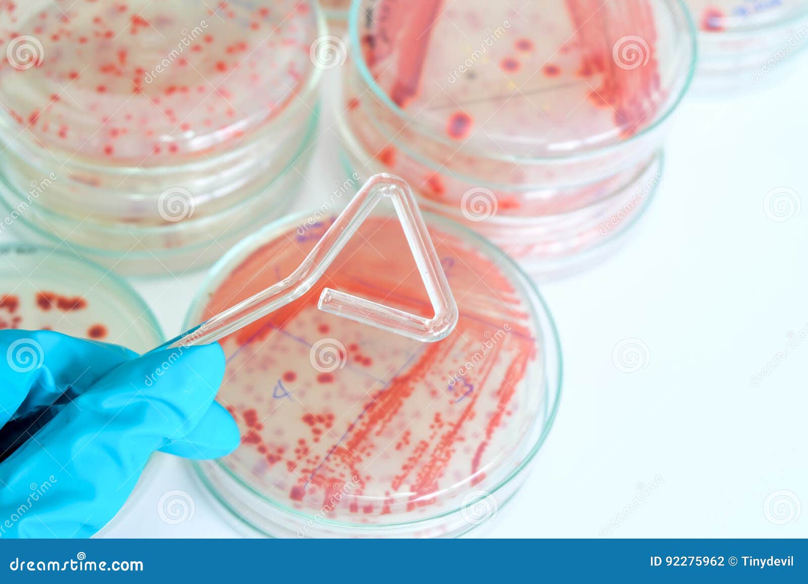 Red Colony of Becteria in Petridish Stock Photo - Image of becteria ...