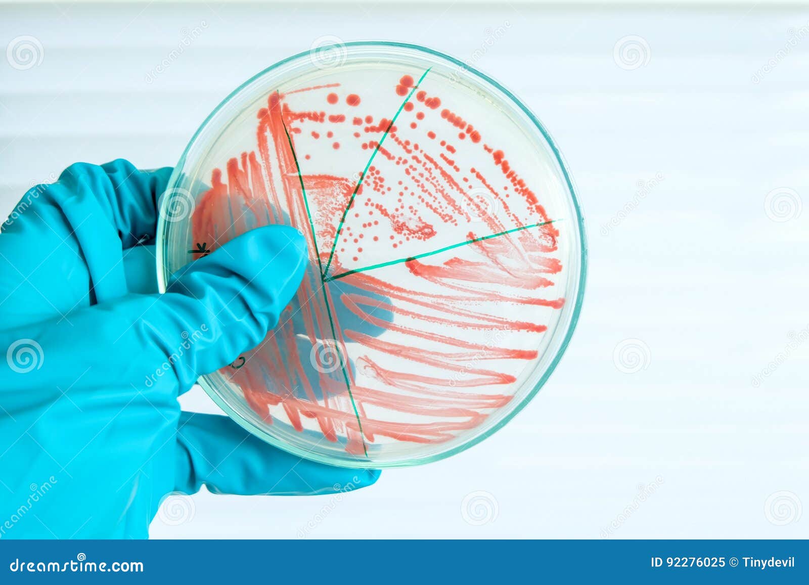 Red Colony of Becteria in Petridish Stock Image - Image of biology ...