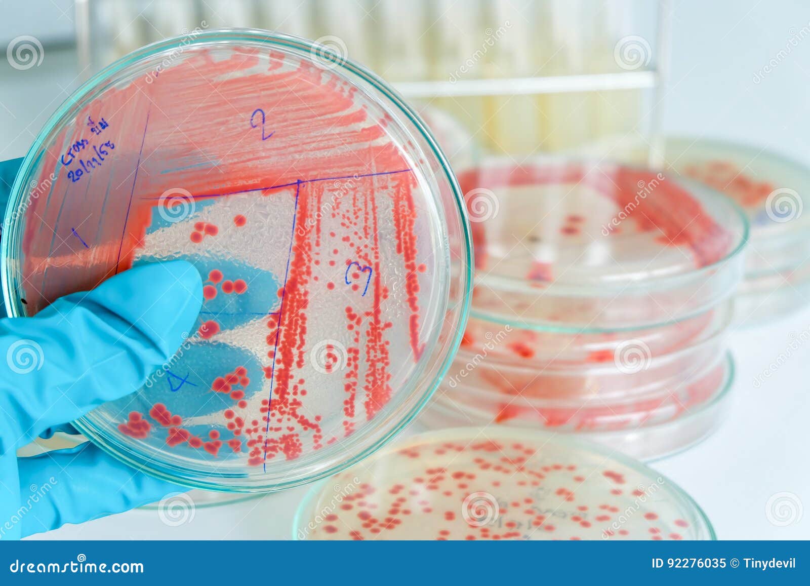 Red Colony of Becteria in Petridish Stock Image - Image of laboratory ...