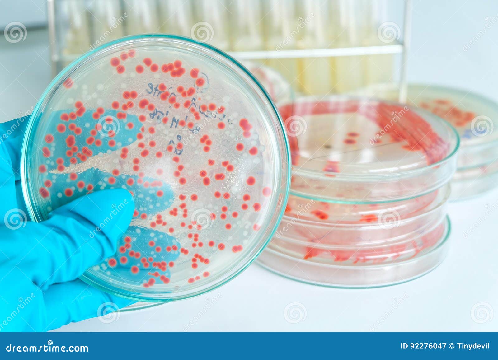 Red Colony of Becteria in Petridish Stock Image - Image of ...