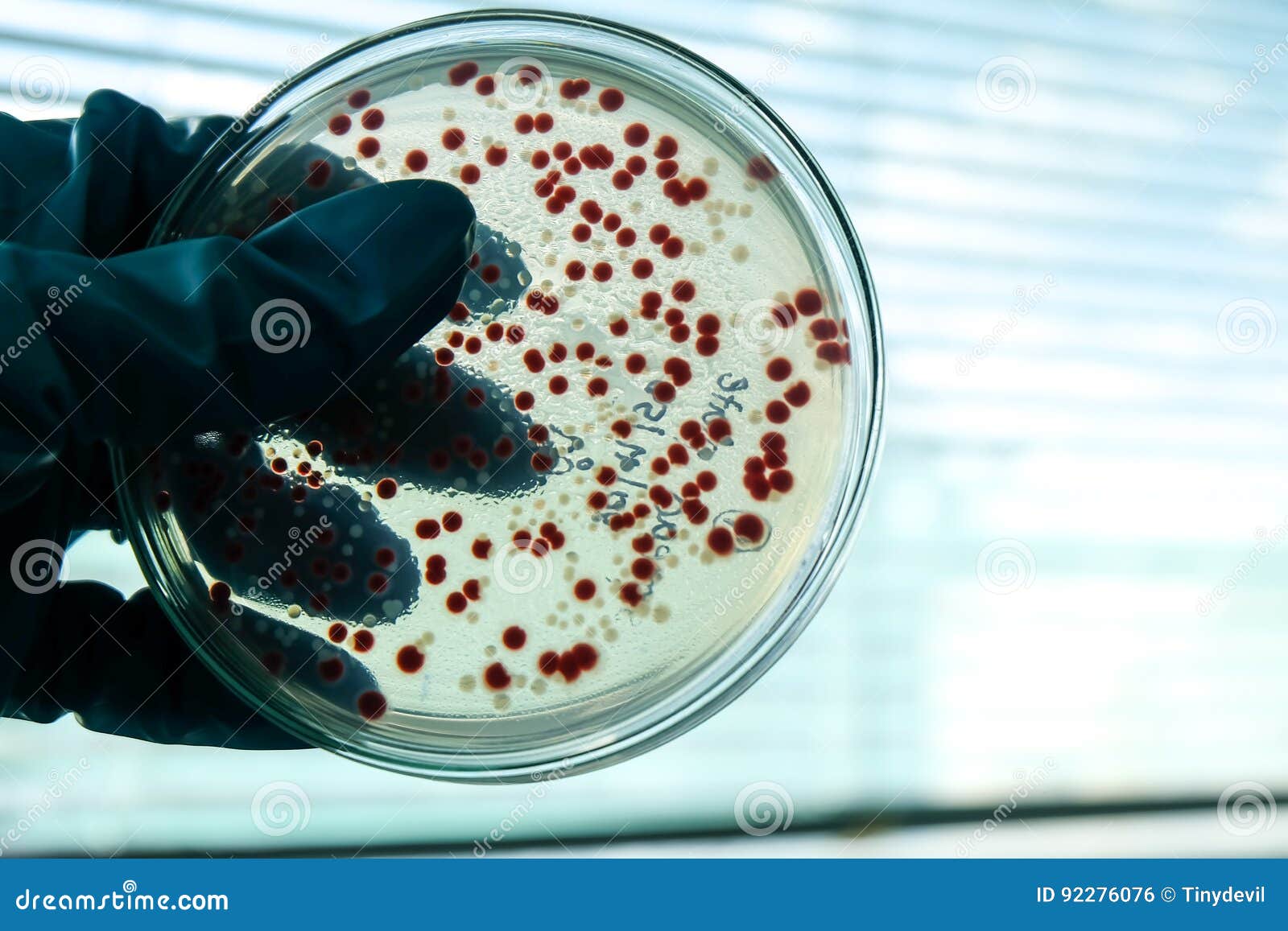 Red Colony of Becteria in Petridish Stock Photo - Image of medical ...