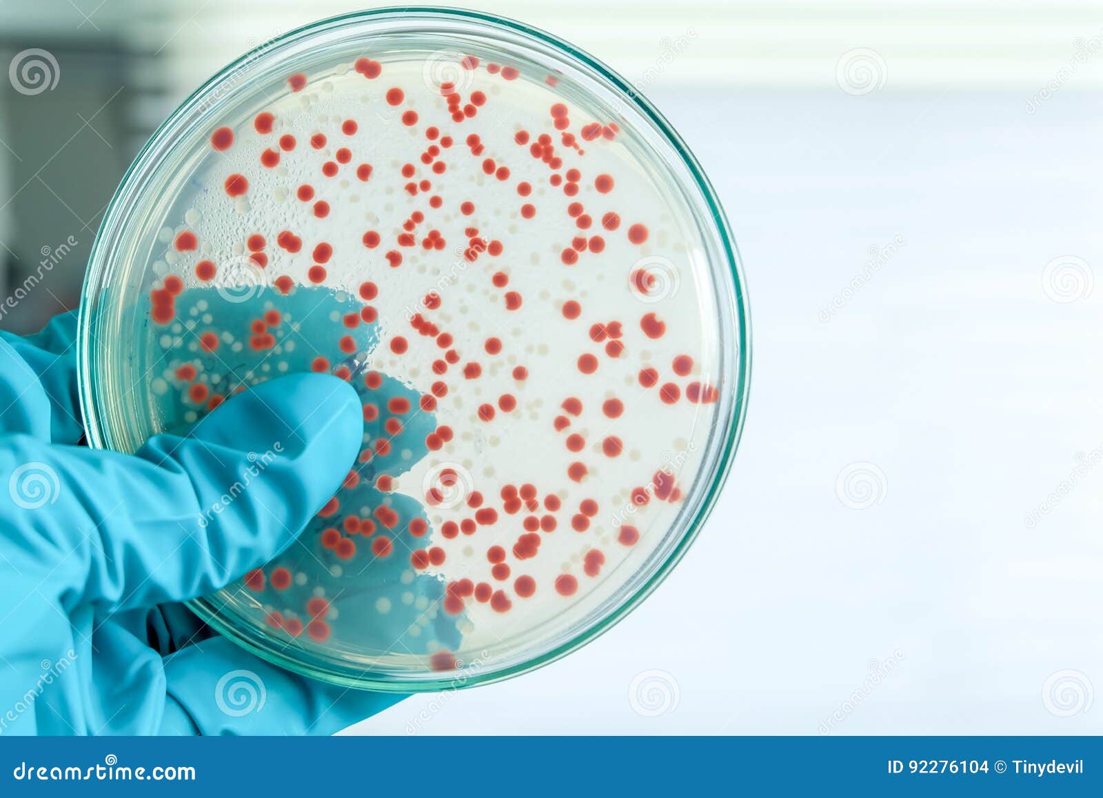 Red Colony of Becteria in Petridish Stock Photo - Image of fungi, agar ...