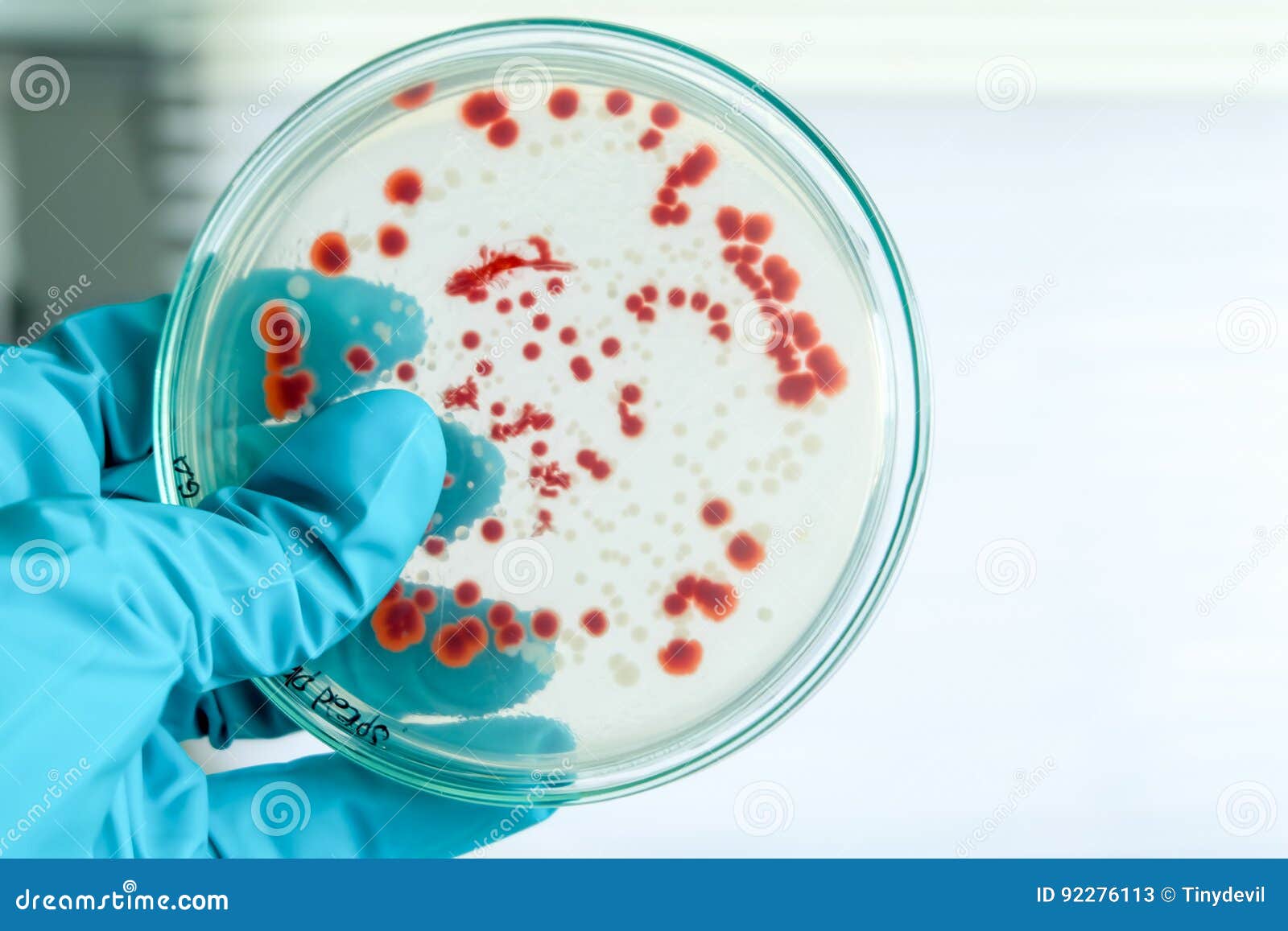 Red Colony of Becteria in Petridish Stock Image - Image of education ...
