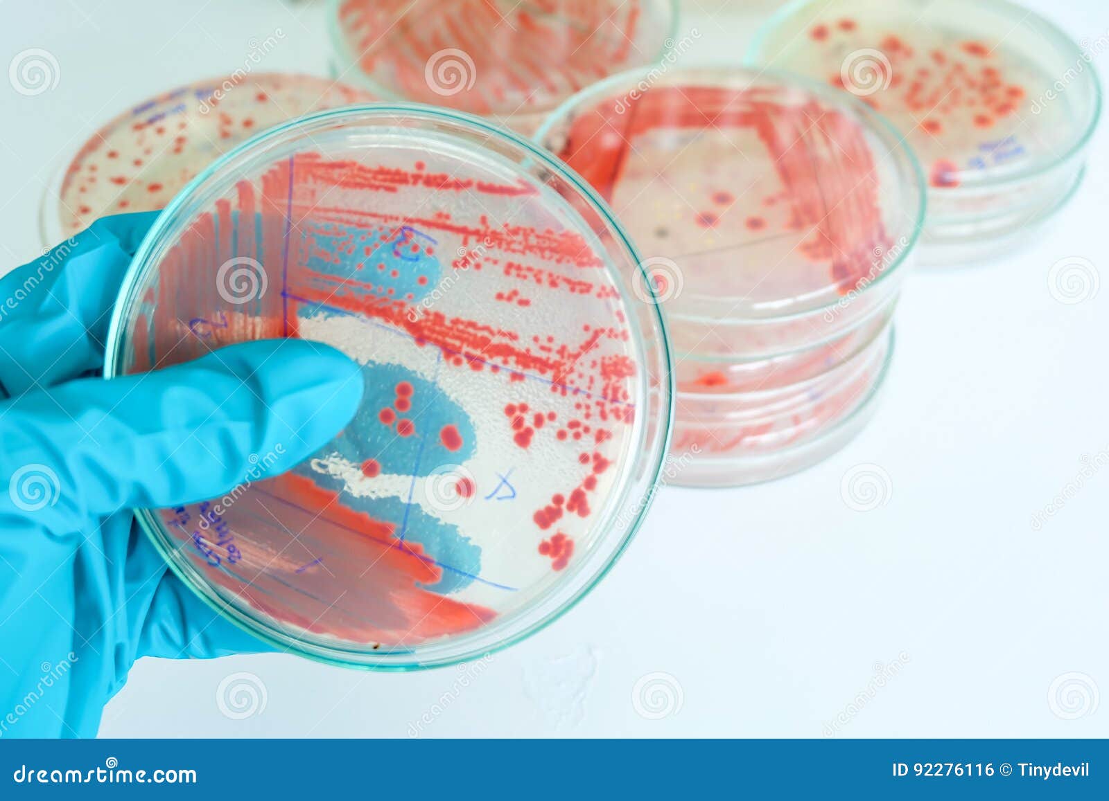Red Colony of Becteria in Petridish Stock Photo - Image of microbiology ...