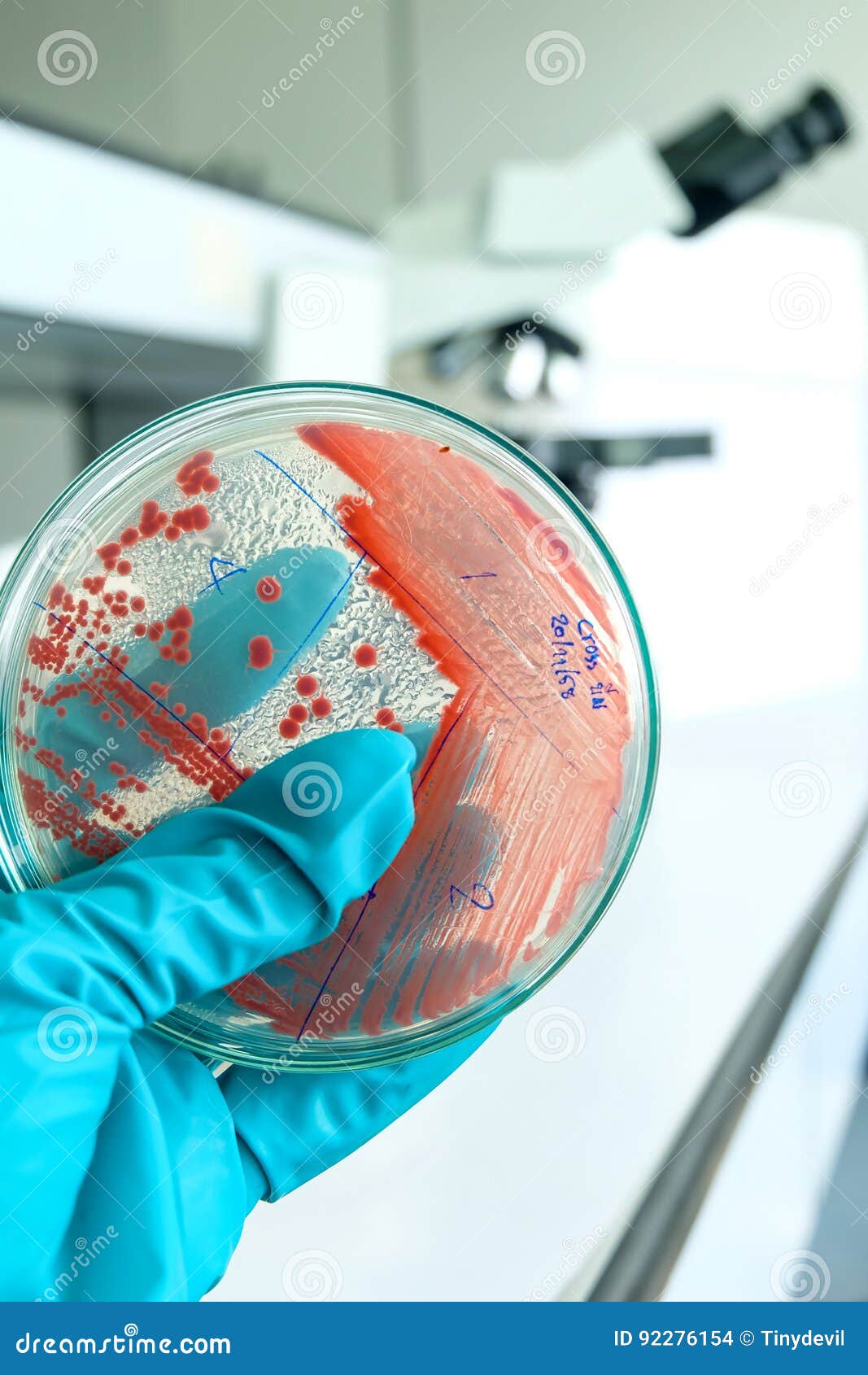 Red Colony of Becteria in Petridish Stock Photo - Image of blue, care ...