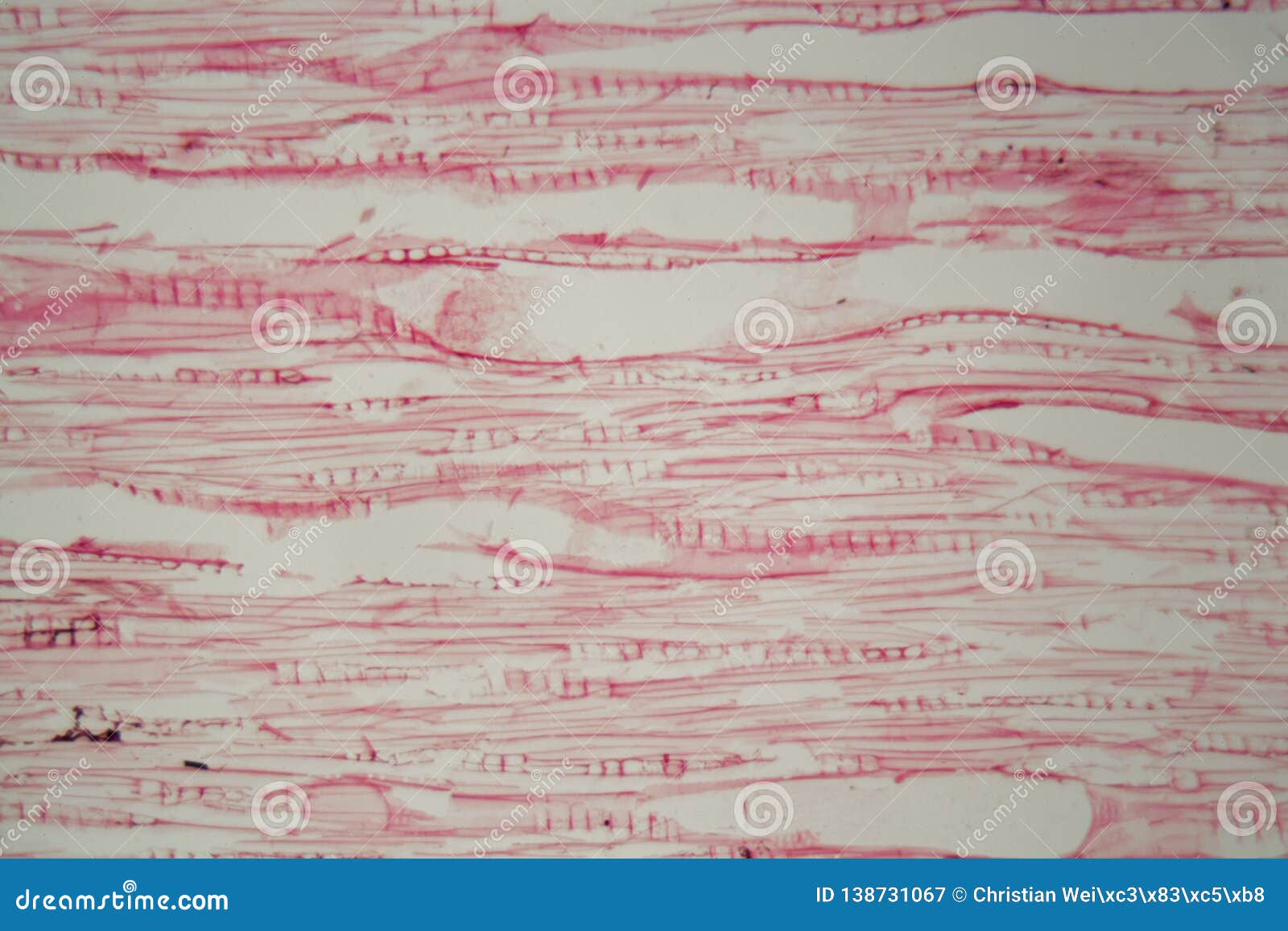 Wood Cells Destroyed by Fungus Under a Microscope Stock Image - Image ...