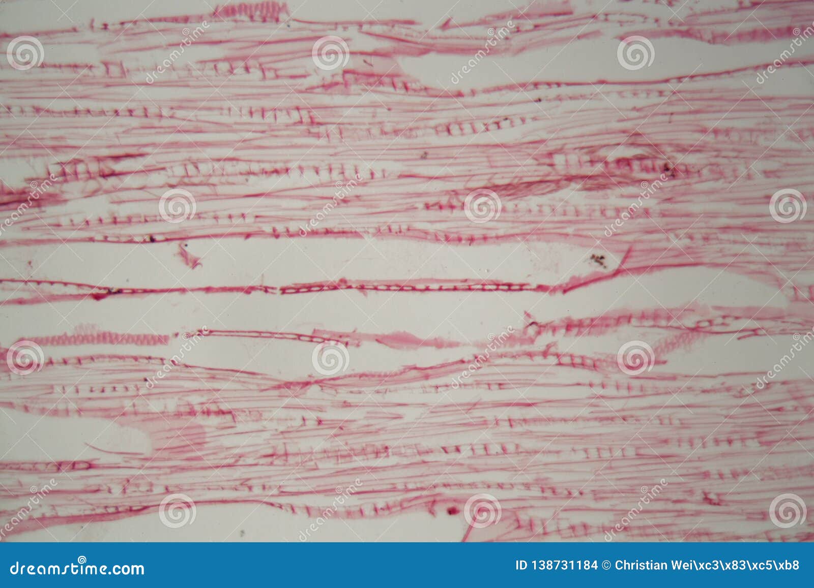Wood Cells Destroyed by Fungus Under a Microscope Stock Photo - Image ...