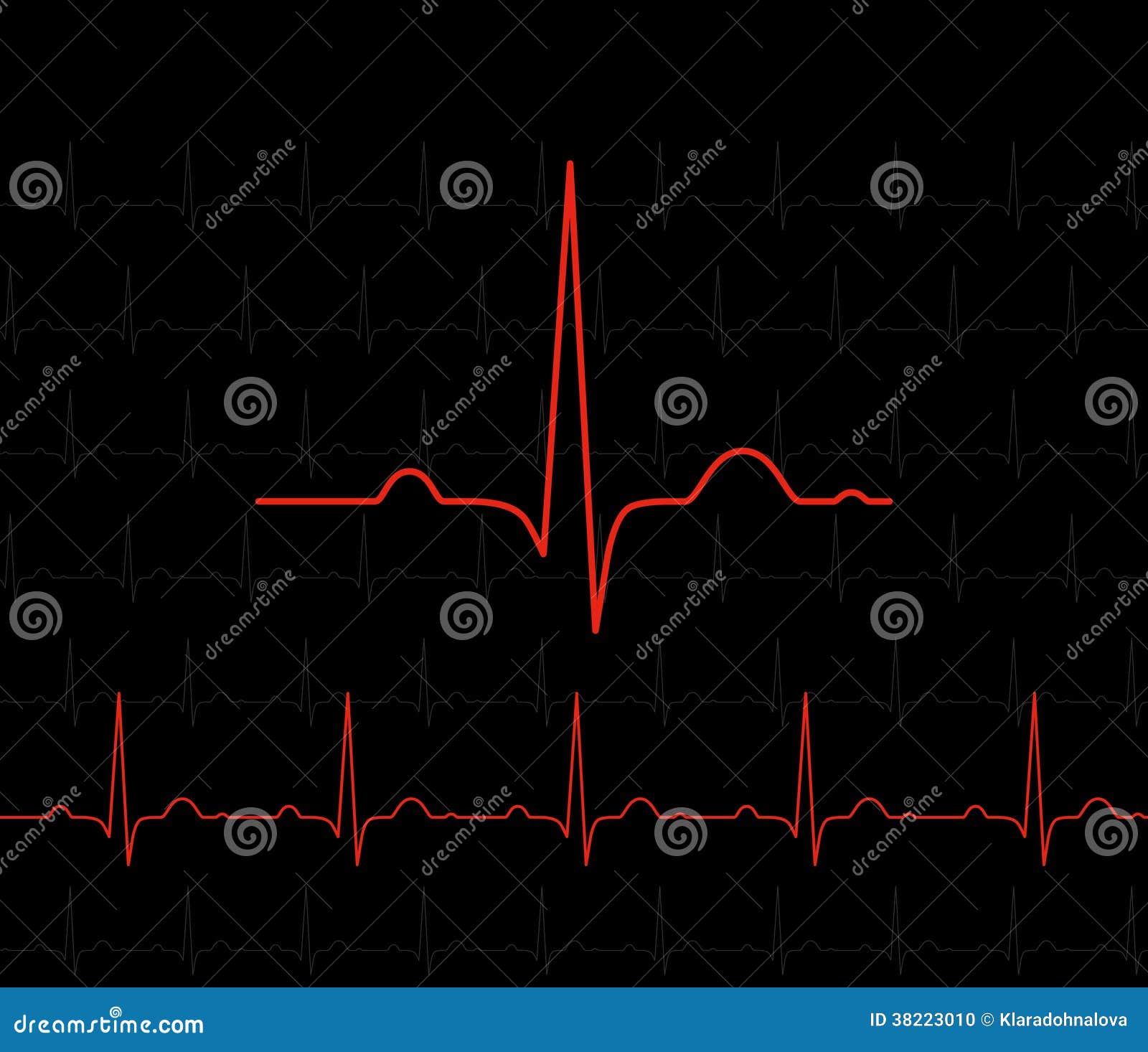 Red EKG Symbol On Black - Medical Background Stock Photo - Image: 38223010