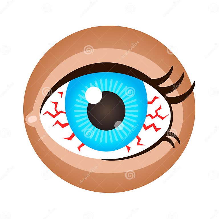 Red eye. stock vector. Illustration of human, black, infection - 92723685