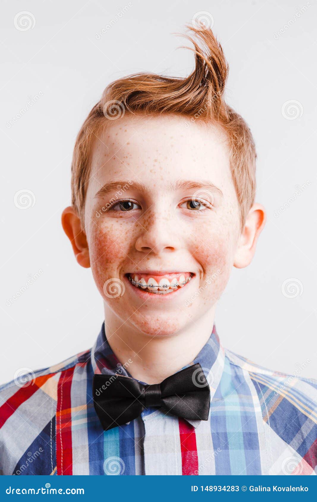 Red Haired Nerd With Braces And Glasses On A White Background Stock Image Image Of Ginger