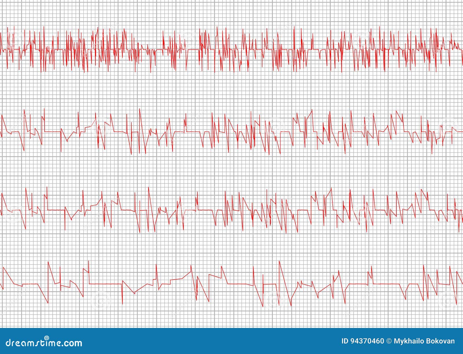 Red Heart cardiogram stock vector. Illustration of analysis - 94370460