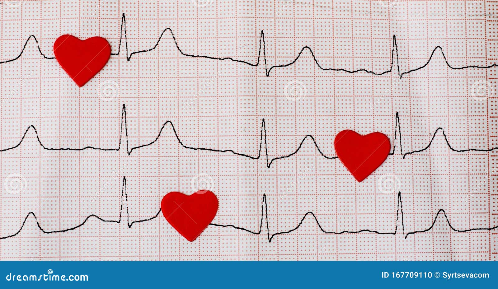 Red Hearts On A Cardiogram A Heartbeat Symbol Close Up Of An