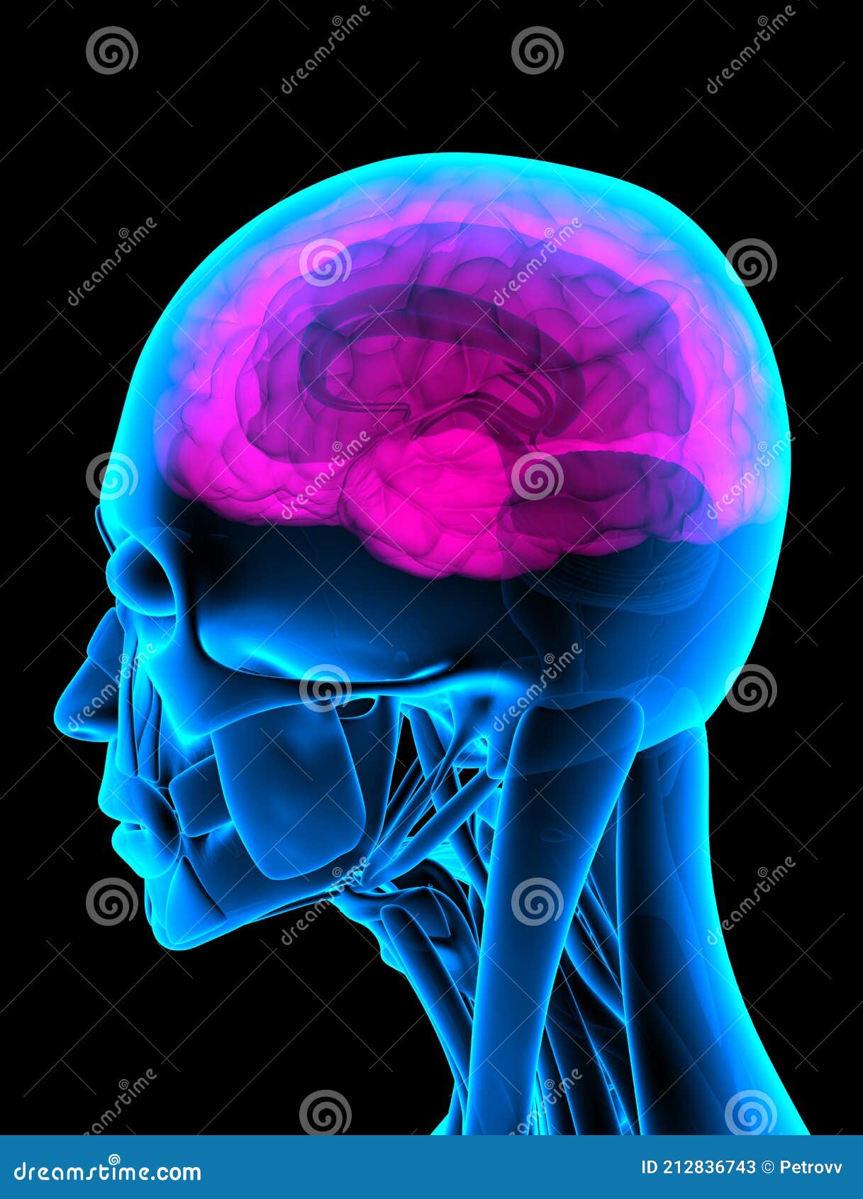 Red human brain x-ray stock illustration. Illustration of headache ...