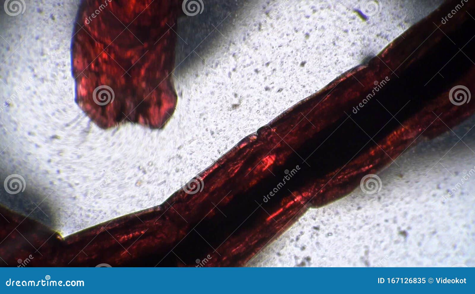 The Red Larva of the Mosquito is Translucent in a Microscope Stock ...