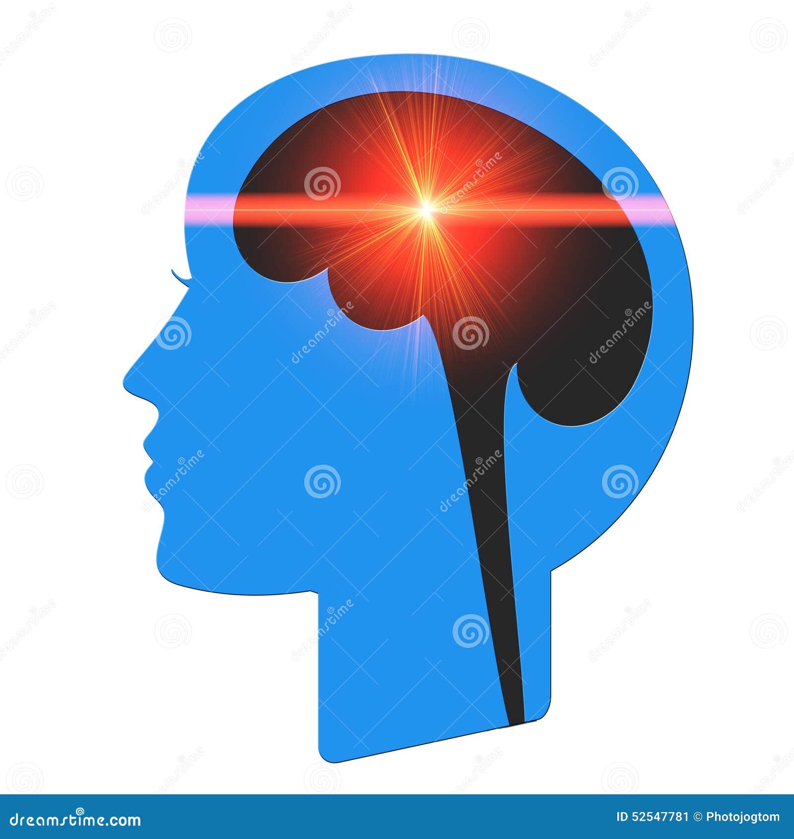 Red light ray in head stock illustration. Illustration of health - 52547781