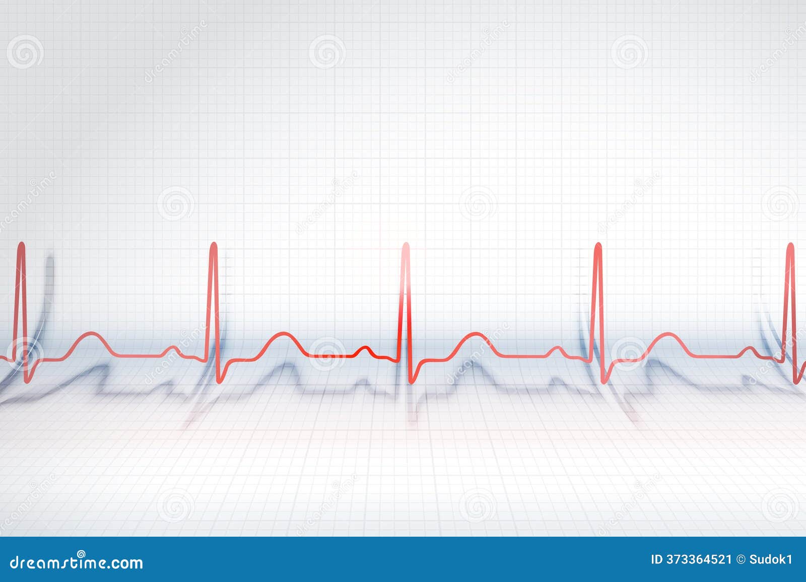 Ecg Cartoons, Illustrations & Vector Stock Images - 29737 Pictures to ...