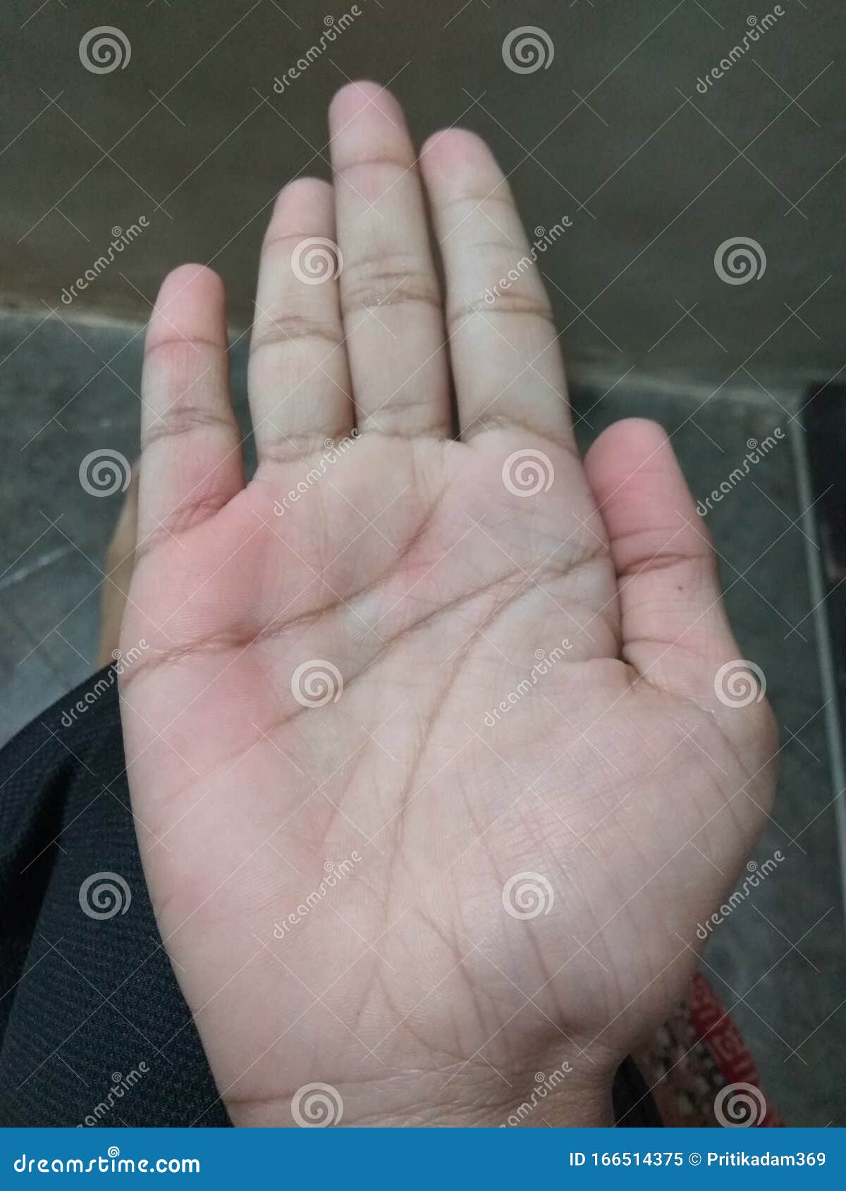 RED marks on a hand stock image. Image of infection - 166514375