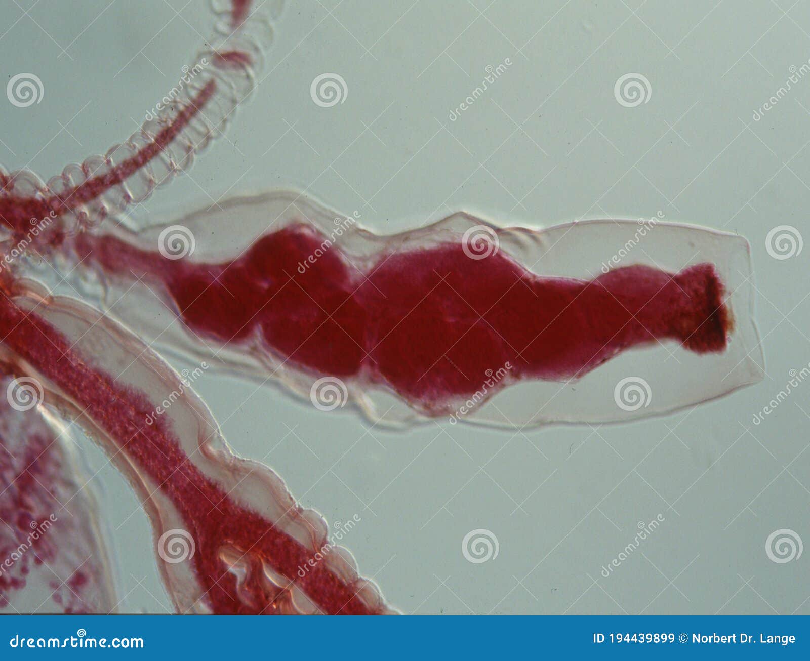 Red polyp stick stock image. Image of microscope, polyp - 194439899