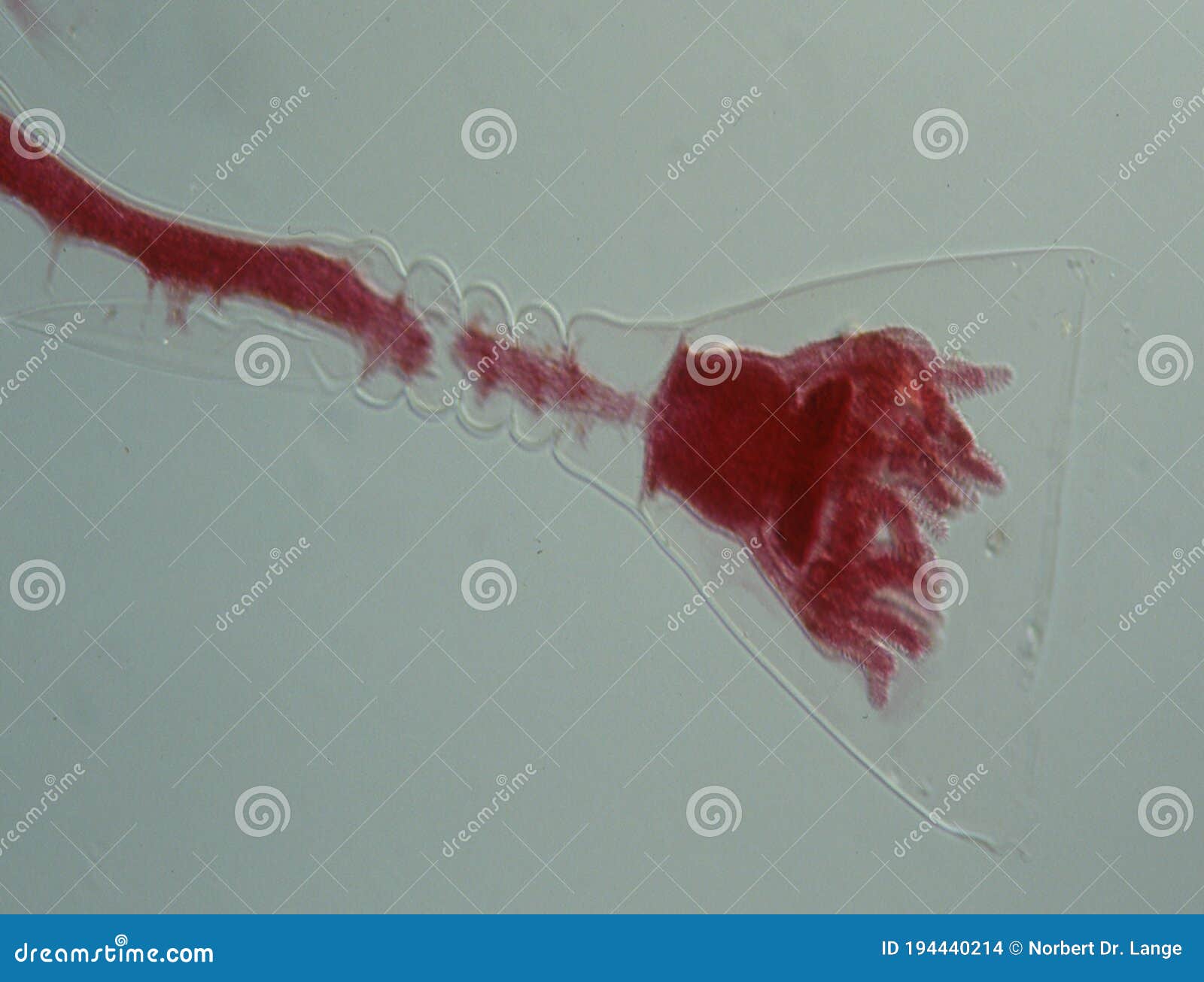 Red Polyp Stick Under the Microscope Stock Photo - Image of organism ...