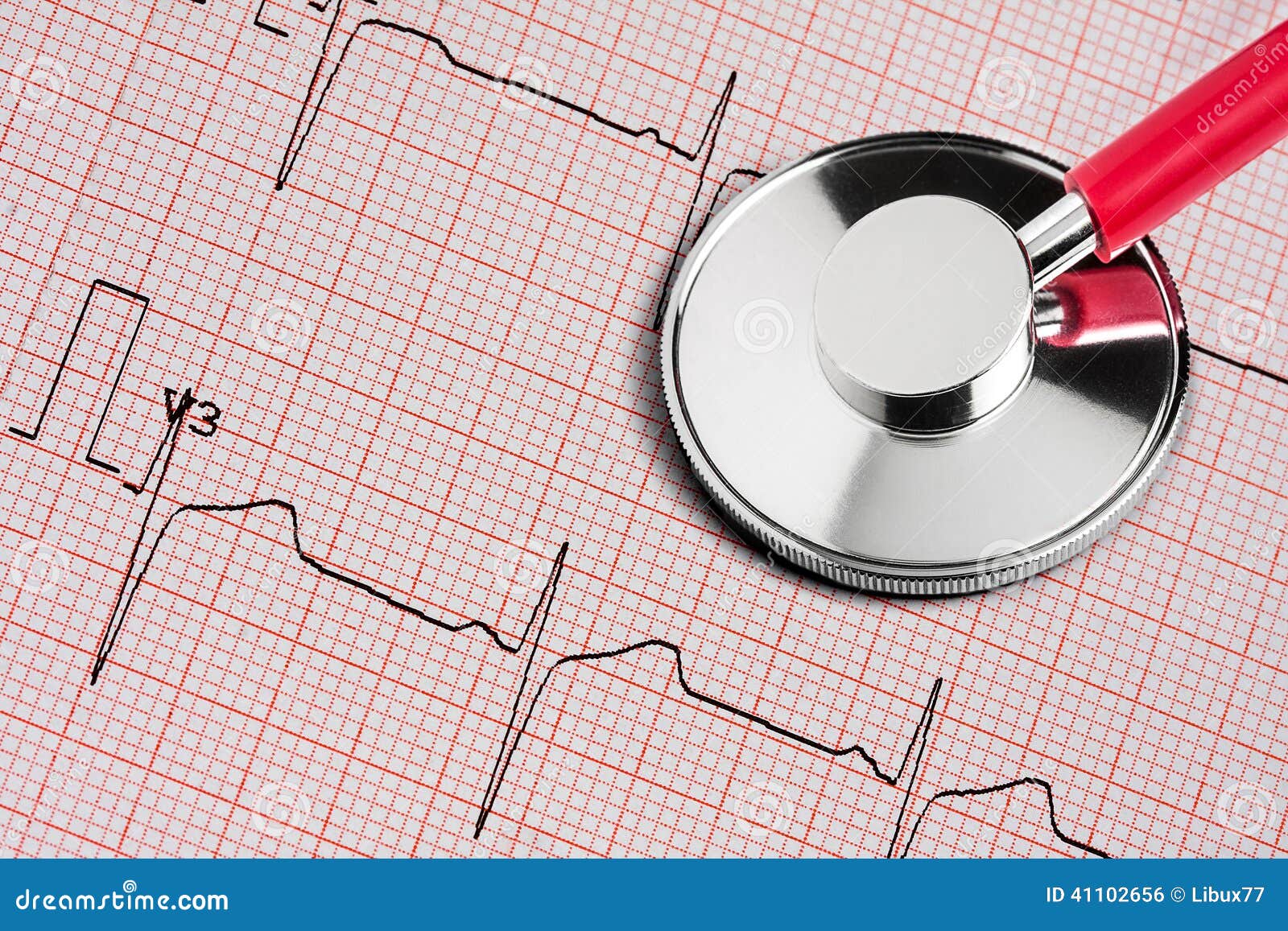 Red Stethoscope ECG chart stock photo. Image of diagnosis - 41102656