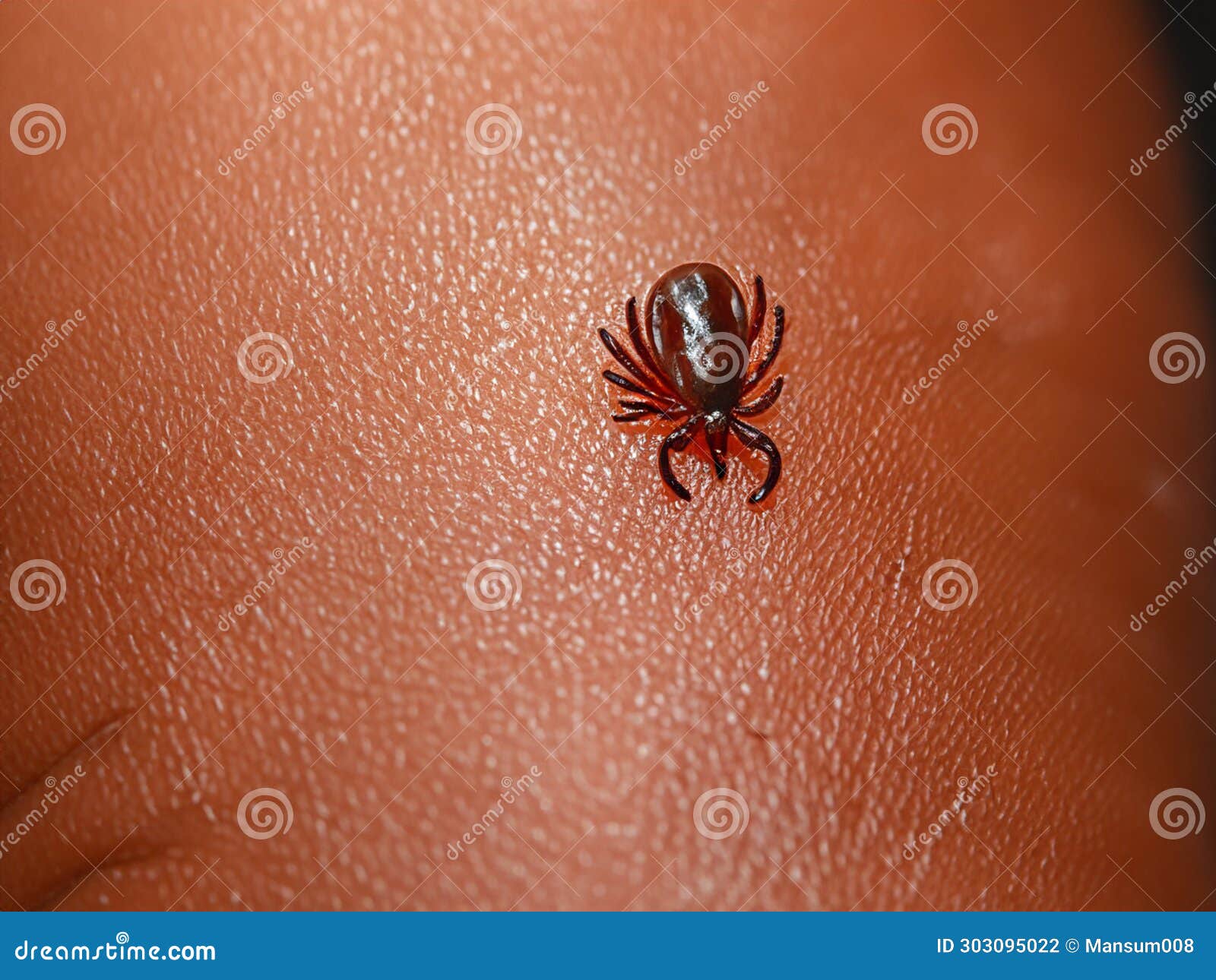 Red tick on the human arm stock illustration. Illustration of macro ...